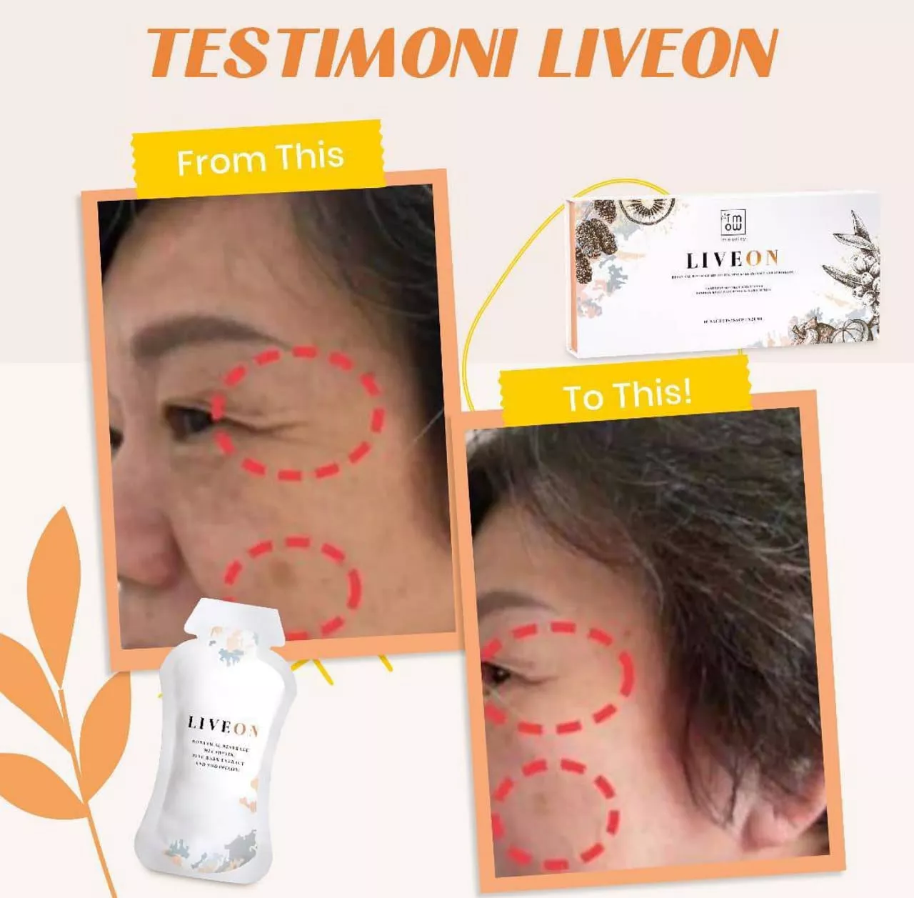 Know why there are pimples on | Galeri disiarkan oleh 1grp_Stella97gu | Lemon8
