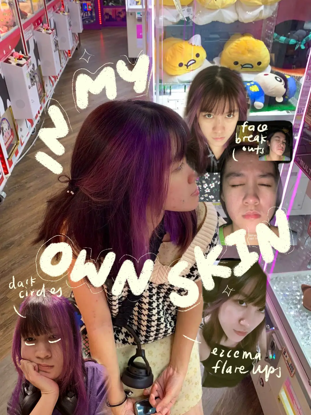 BEING IN MY OWN SKIN🌟 | แกลเลอรีที่โพสต์โดย cloud | Lemon8