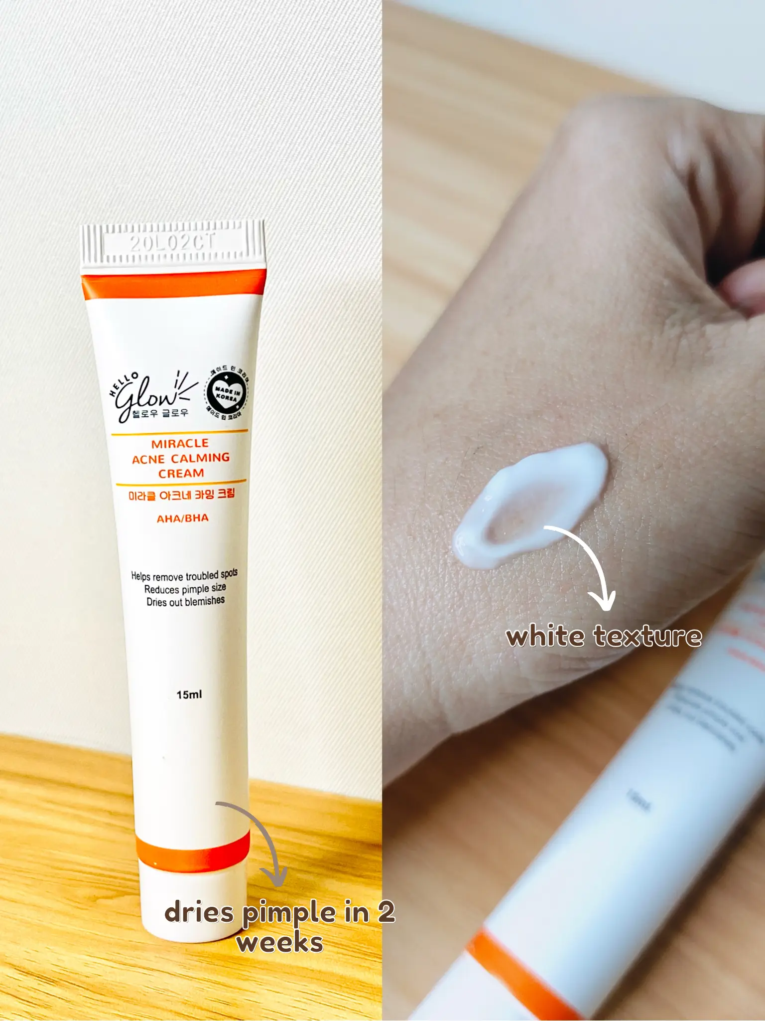 Acne Spot Cream Which one is effective? | Gallery posted by Ashy Jasareno | Lemon8