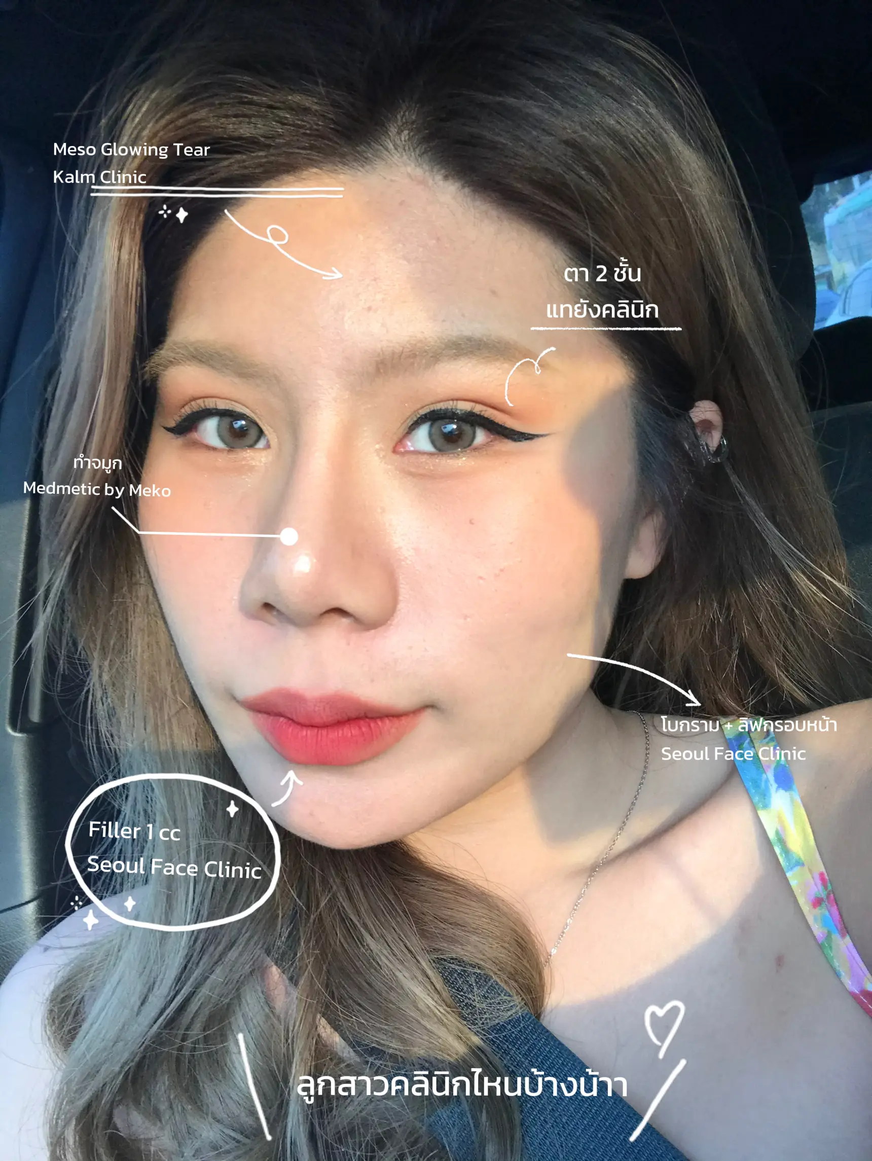 จะสวยทั้งทีต้องกี่คลินิก 😂 | แกลเลอรีที่โพสต์โดย aaom penelopy | Lemon8