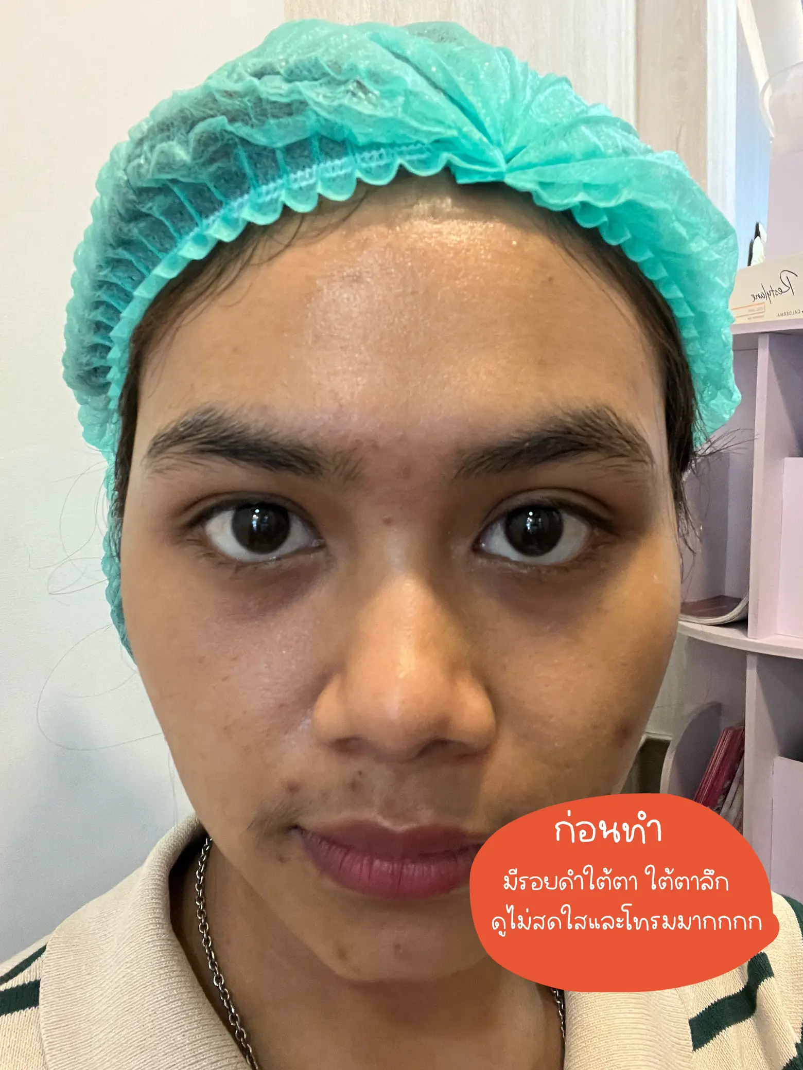 radiant codeฉีด - การค้นหาใน Lemon8