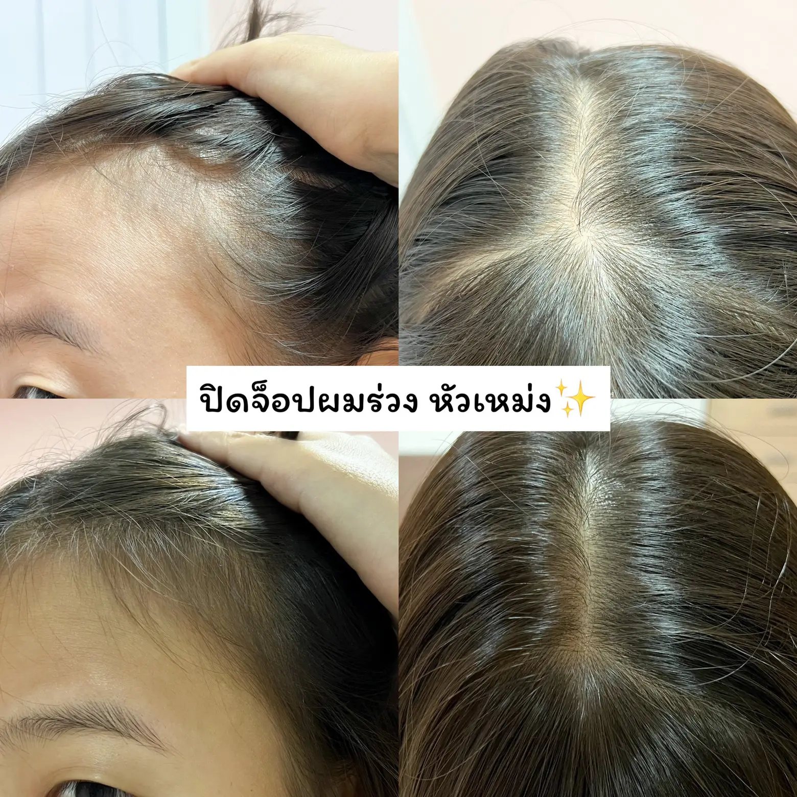 19 ไอเดียยอดนิยมเกี่ยวกับ Japanese Okanen Shampoo รีวิว ในปี 2024