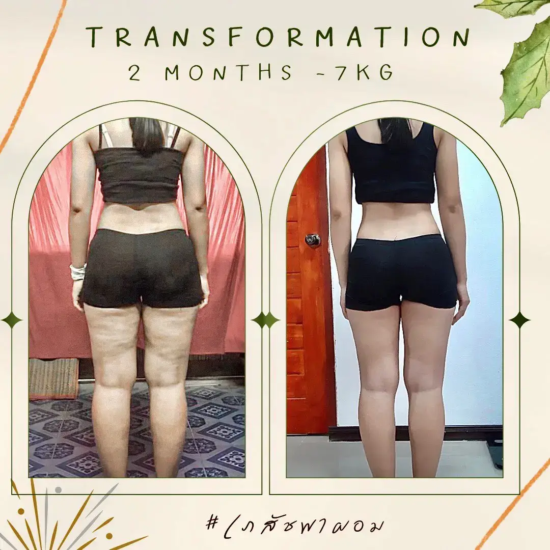 ️ How to ลดเซลลูไลท์ใน 2 เดือน | แกลเลอรีที่โพสต์โดย Kung Chayanit | Lemon8