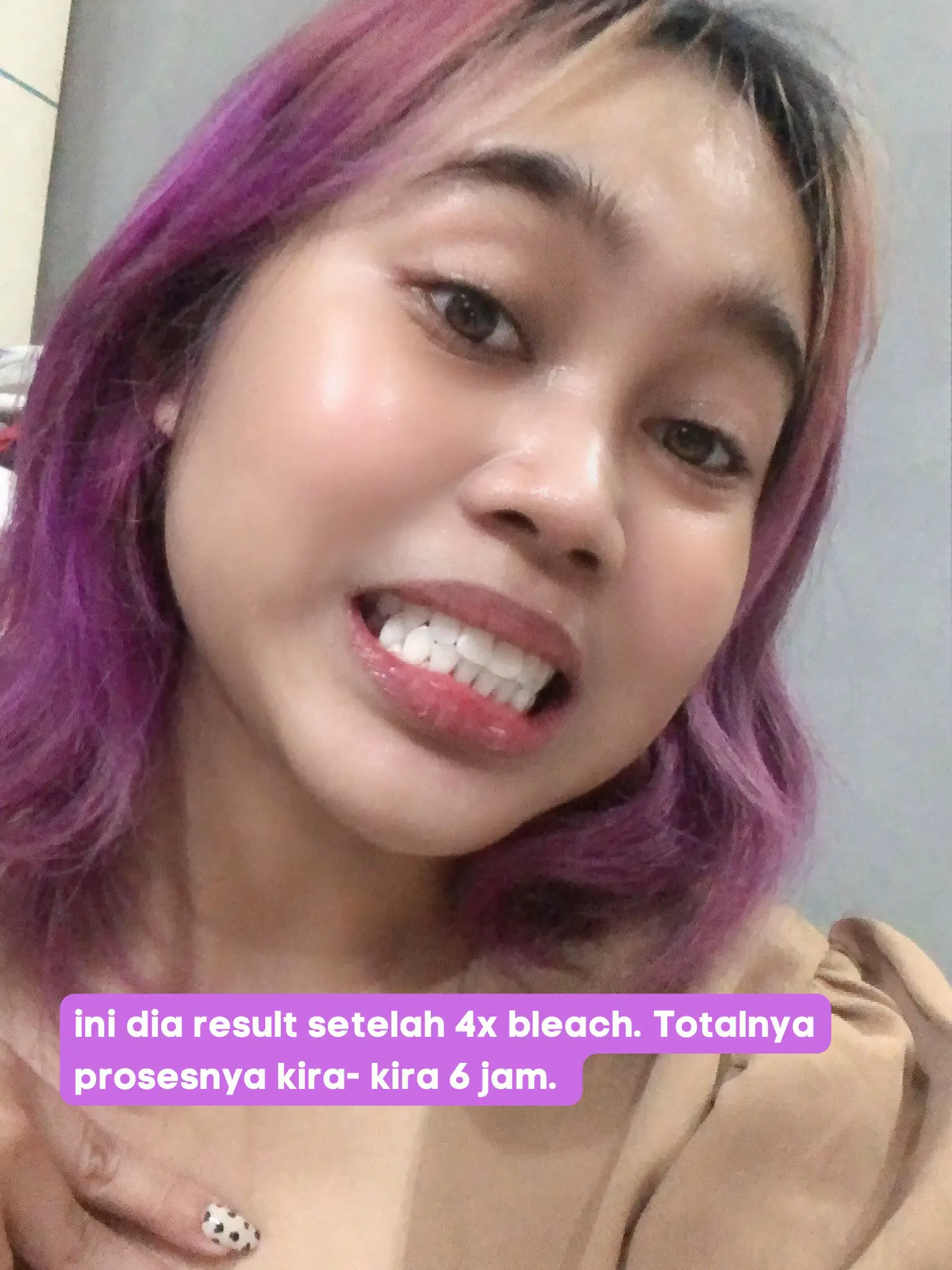 BLEACHING GIGI GRATIS!! | Galeri diposting oleh Yuka | Lemon8