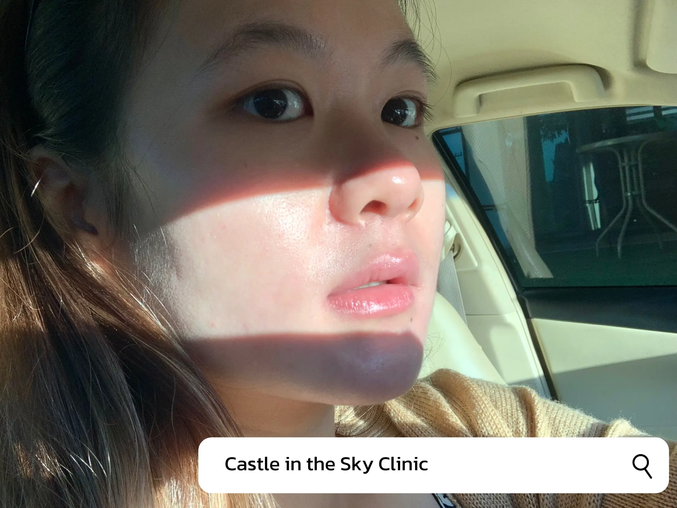 รักษาสิวที่ Castle in the Sky Clinic 𓎩 ⸝⸝ | แกลเลอรีที่โพสต์โดย ffahhai | Lemon8