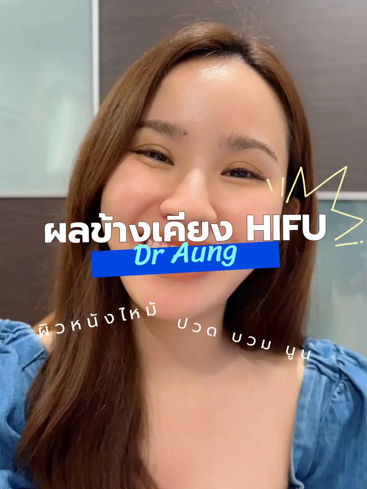 ผลข้างเคียงที่อาจพบได้ หลังทำ HIFU | วิดีโอที่เผยแพร่โดย Thewika T. | Lemon8
