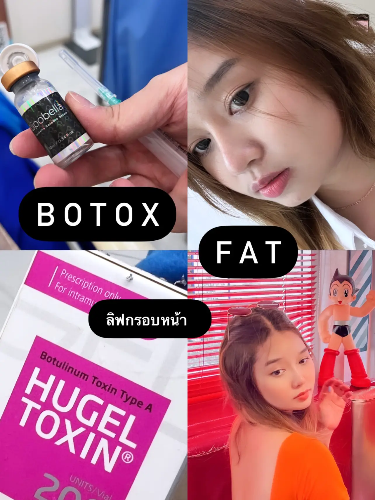 Botox changed lives. | Gallery posted by Littlenaey | Lemon8