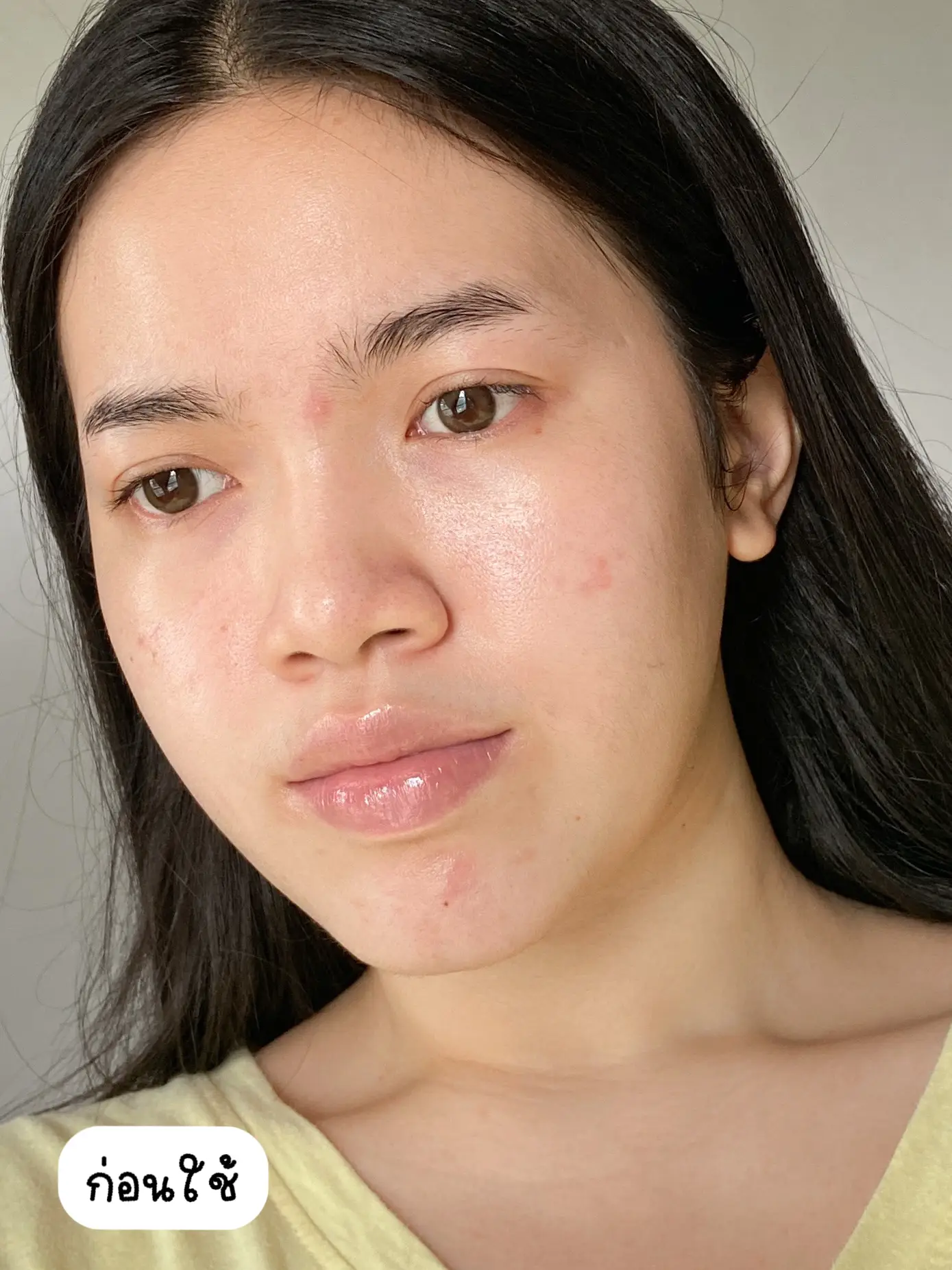 ตัวช่วยป้องกันผิวผดจากฝุ่น pm2.5 | แกลเลอรีที่โพสต์โดย Pcrnan | Lemon8