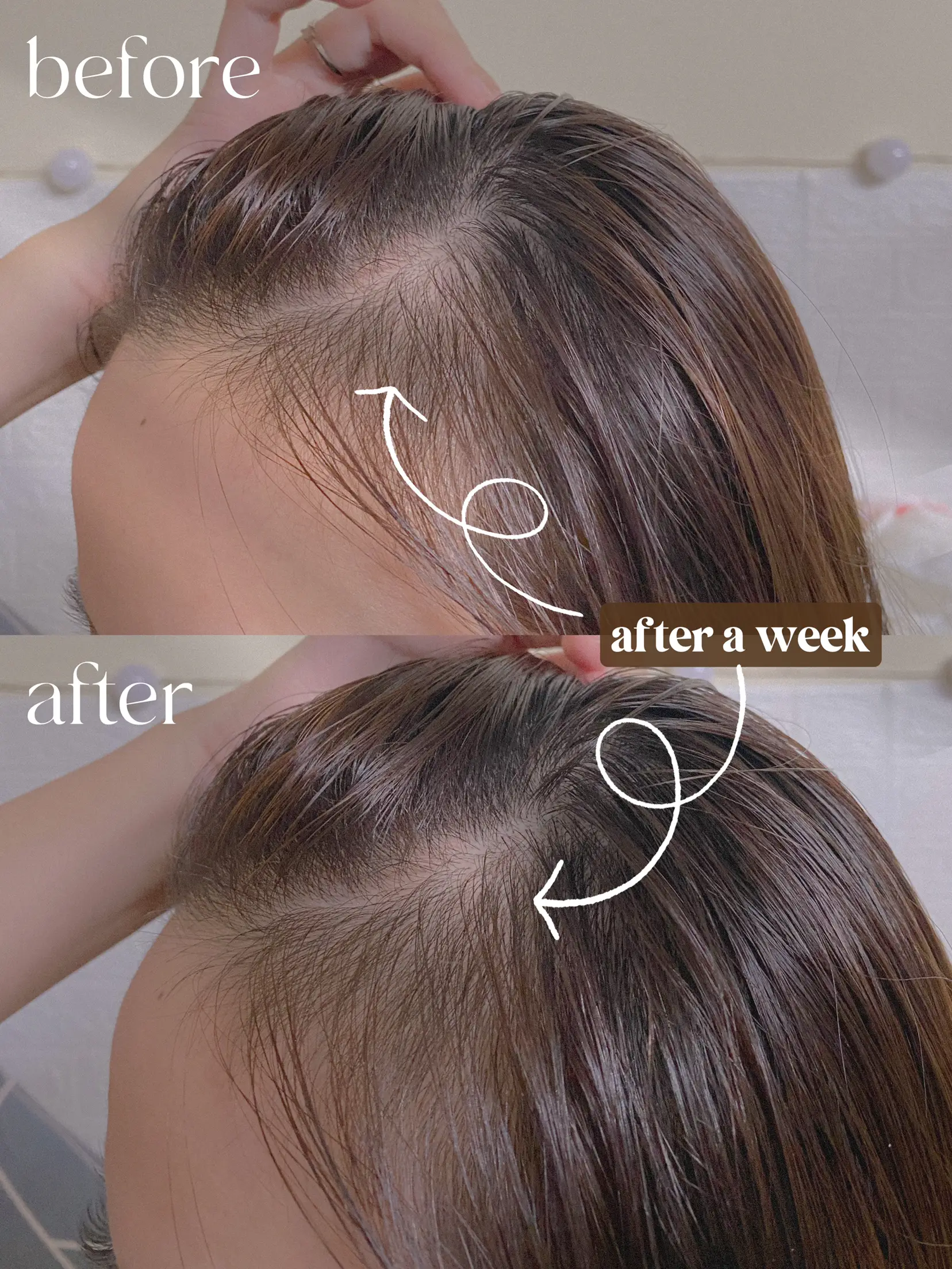 Hair Oil untuk Rambut Rontok | Galeri diposting oleh biergita | Lemon8