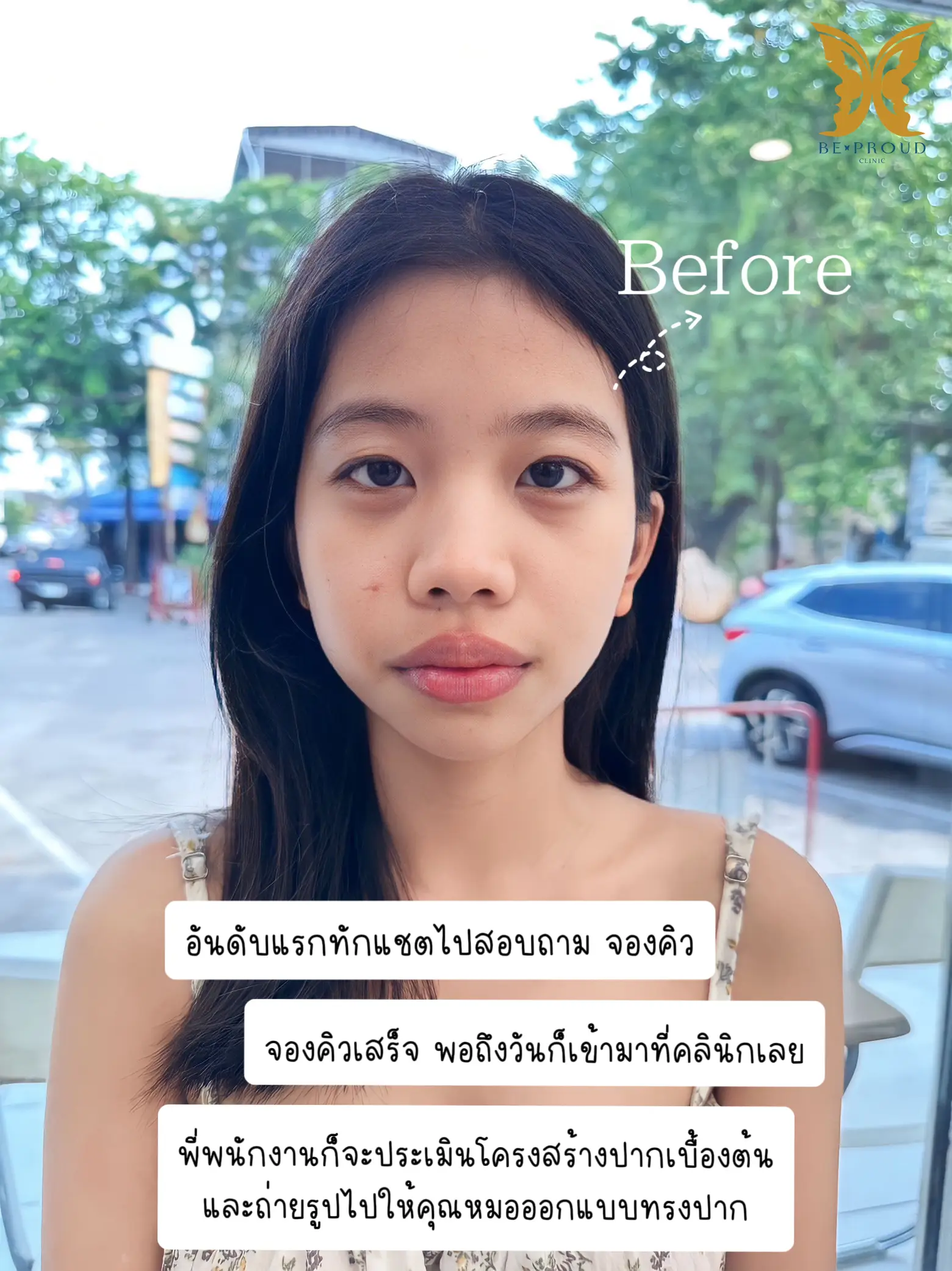 ปั้นปากกระจับ! ง่ายๆ 5 step🫦 | แกลเลอรีที่โพสต์โดย Chanie.ruby | Lemon8