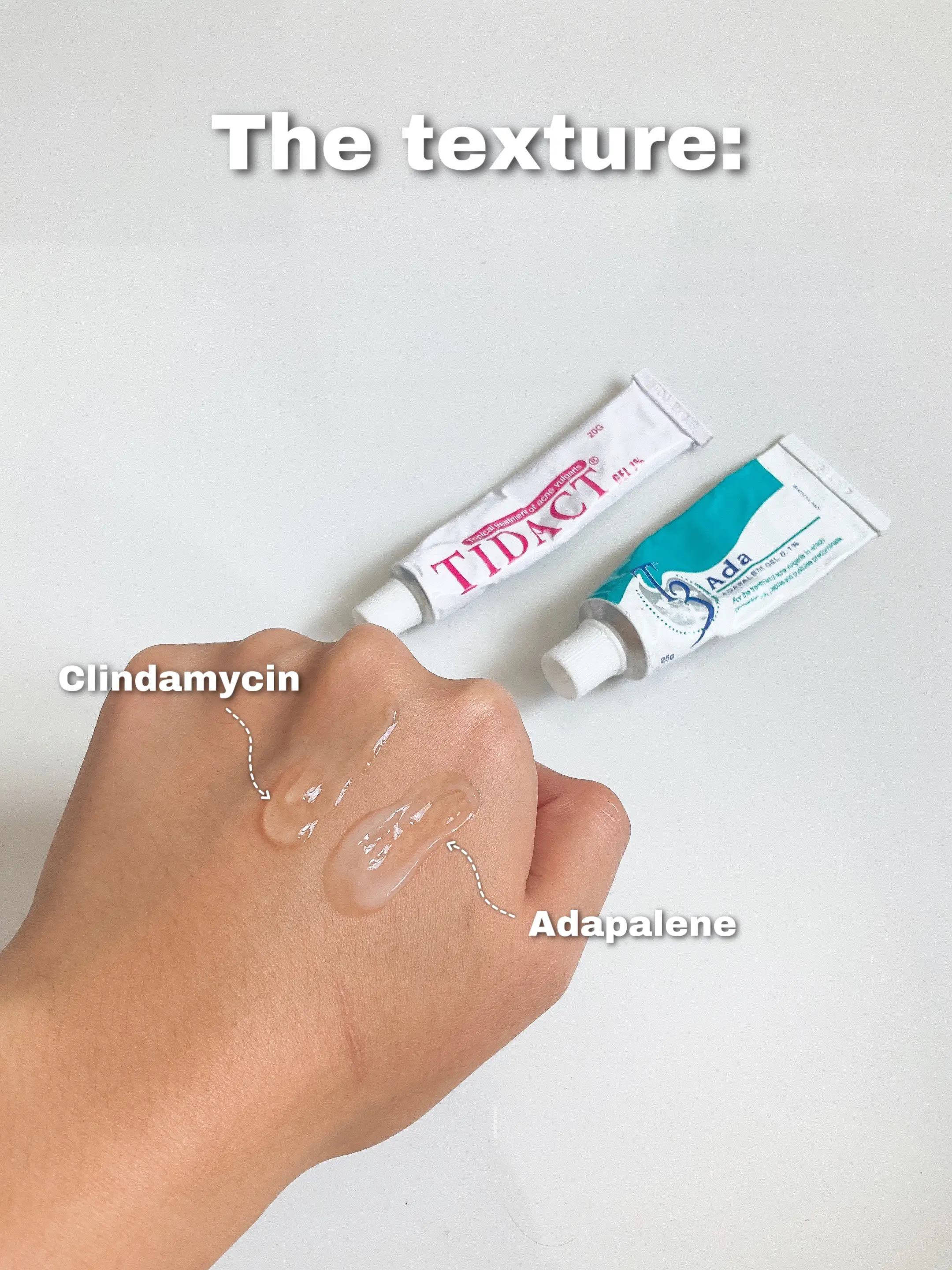 T3 Adapalene Gel Shopping | instrumentation.kmitl.ac.th