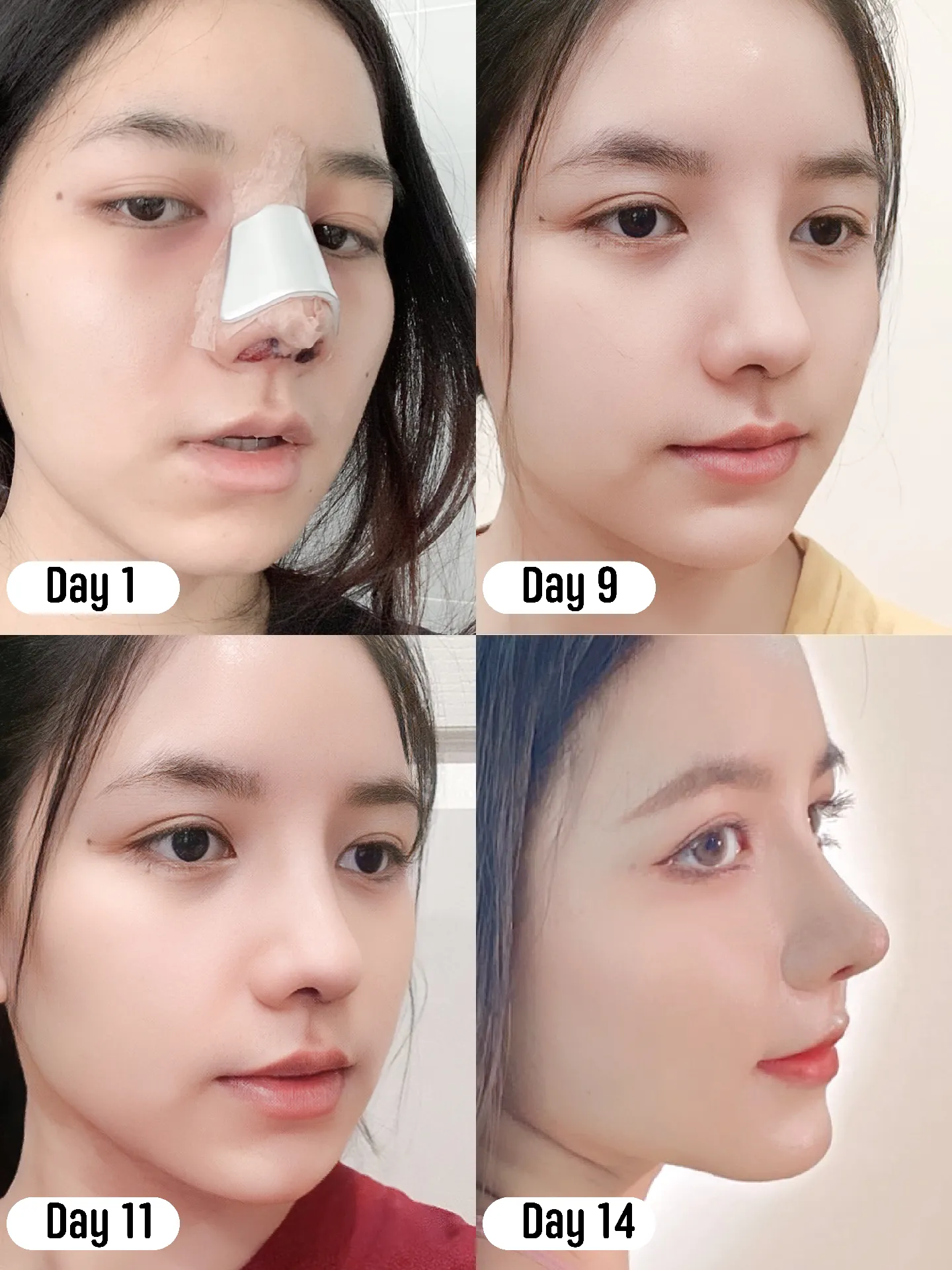 The nose has changed. Really beautiful.‼️ | Gallery posted by NSC ...