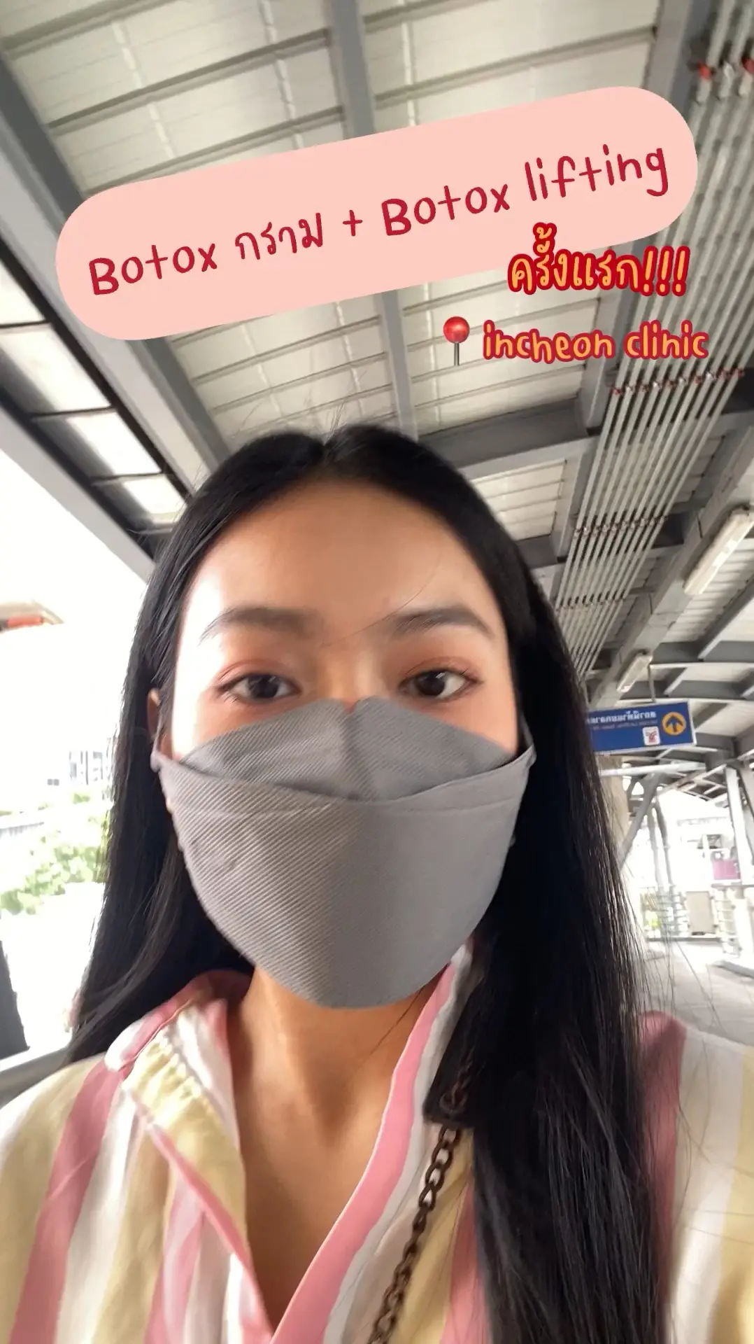 รีวิว Botox กราม + Botox lifting ครั้งแรก!!! 😲 | วิดีโอที่เผยแพร่โดย Fayeris | Lemon8