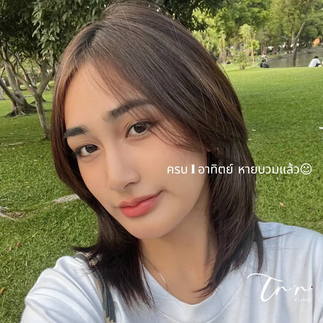 ปากจึ้งเปลี่ยนชีวิต☺️ | แกลเลอรีที่โพสต์โดย Tr'rclinic | Lemon8