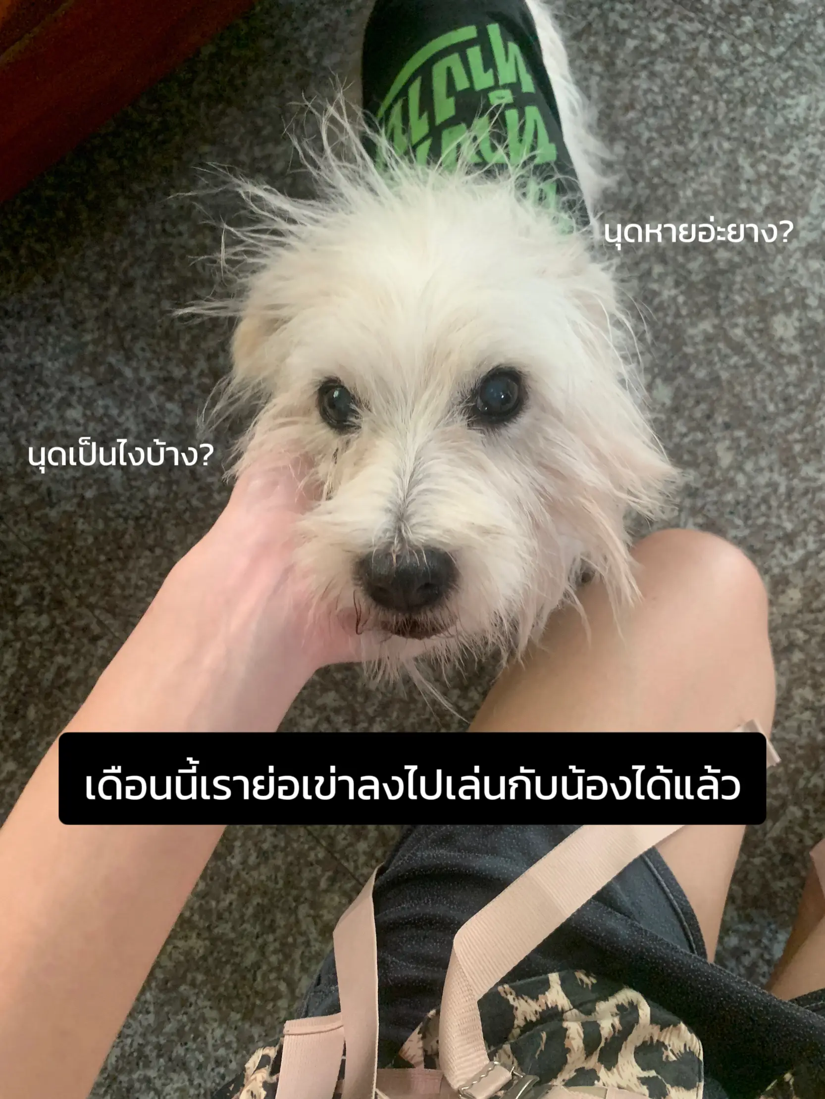 รีวิวช่วงพักฟื้นหลังผ่าตัดกระดูกสันหลังคดในเดือนที่ 2 | แกลเลอรีที่ ...