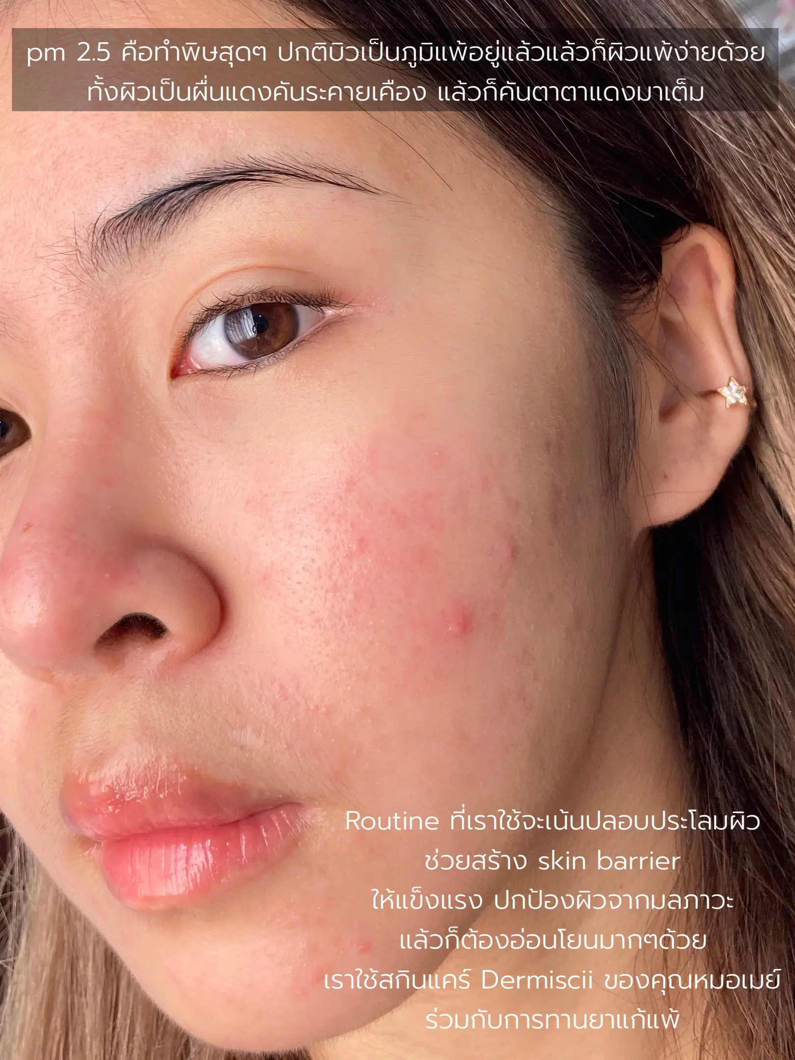 แชร์ Routine เกราะป้องกันผิวแข็งแรงสู้ pm2.5 ‼️ | แกลเลอรีที่โพสต์โดย Beautysweeties | Lemon8