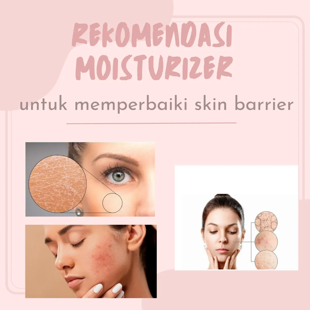 REkOMENDASI moisturizer untuk SKIN Barrier | Galeri diposting oleh Naz17 | Lemon8
