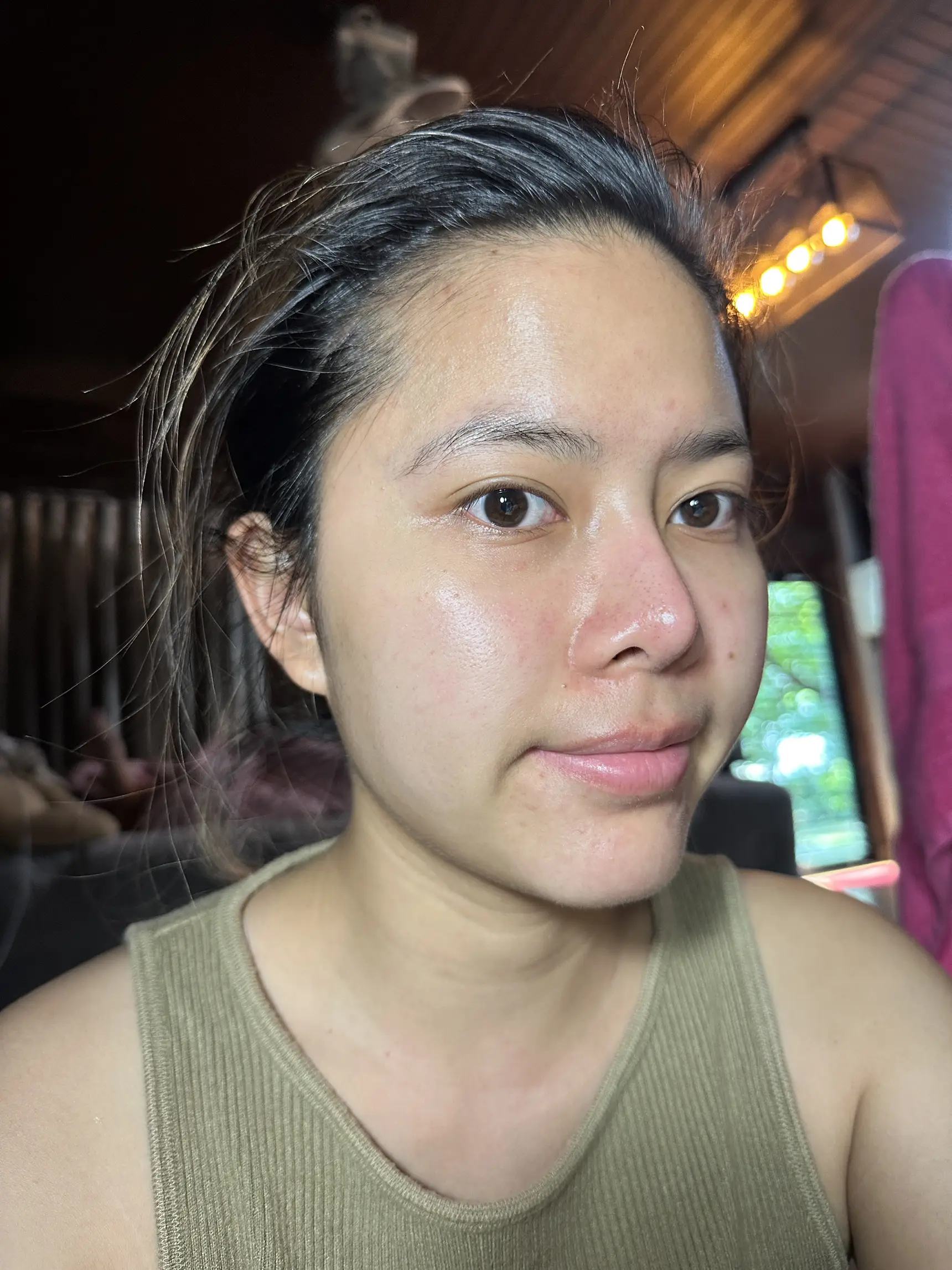 REJURAN ฉบับหน้าใส | แกลเลอรีที่โพสต์โดย ssompns | Lemon8