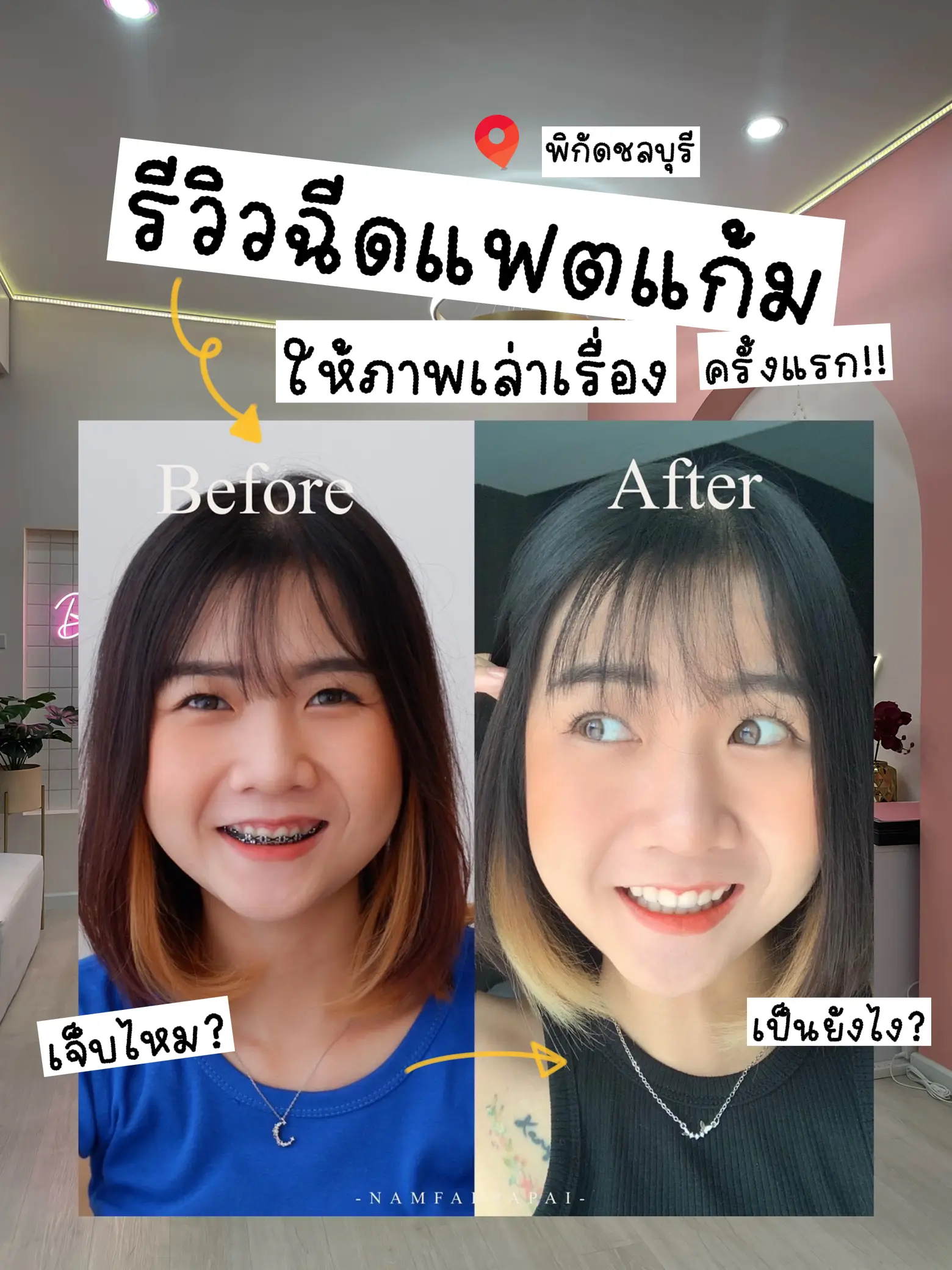 รีวิวlipocaffเมโสแฟตสลายไขมัน - การค้นหาใน Lemon8