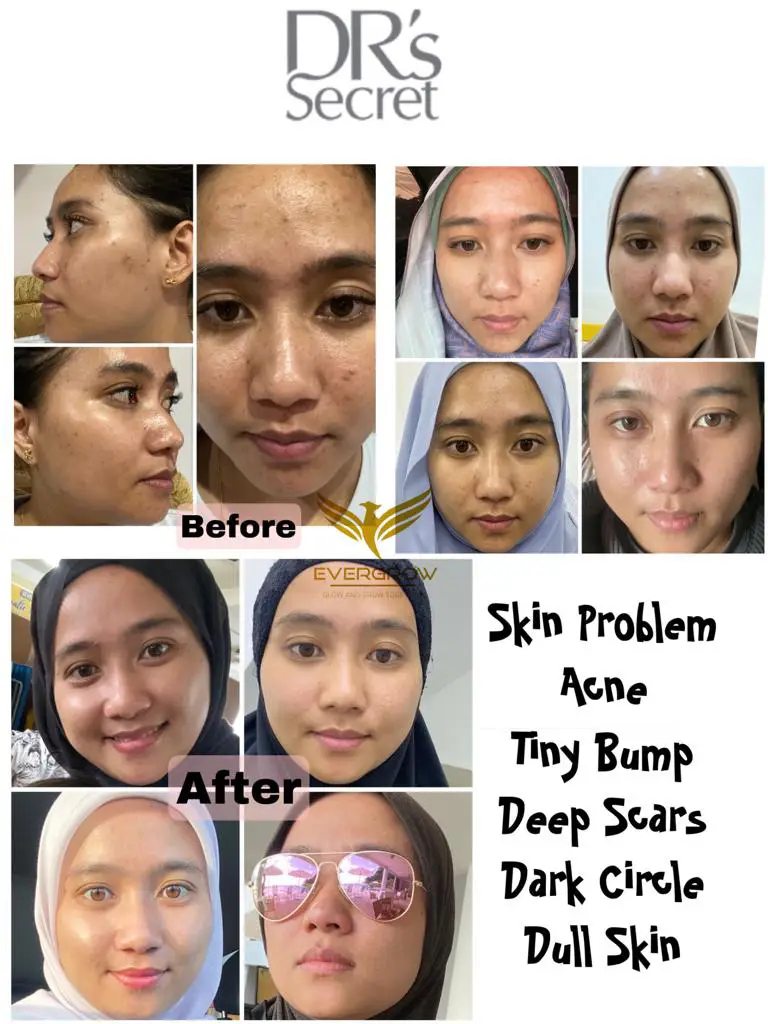 nak glowing for raya? | Gallery posted by shantini | Lemon8