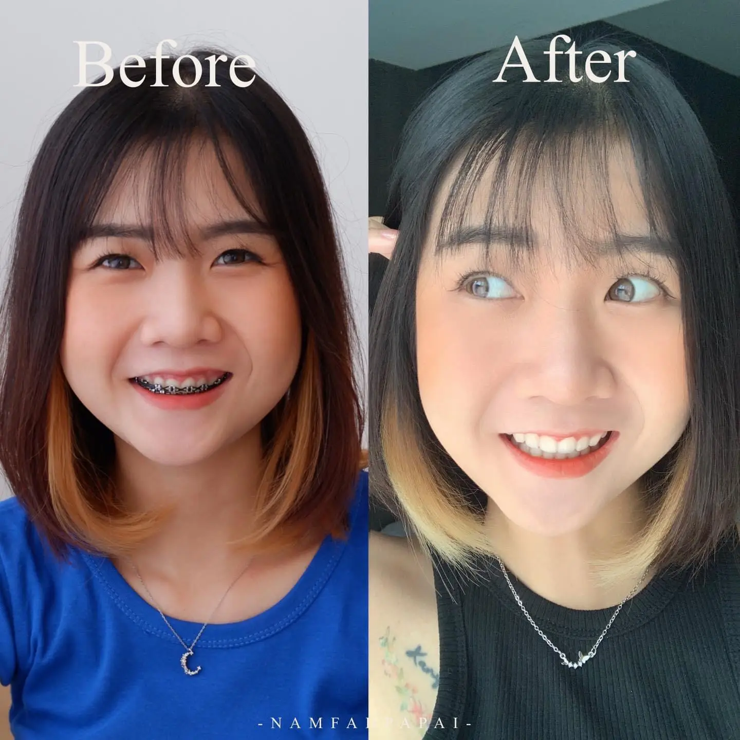 รีวิวlipocaffเมโสแฟตสลายไขมัน - การค้นหาใน Lemon8
