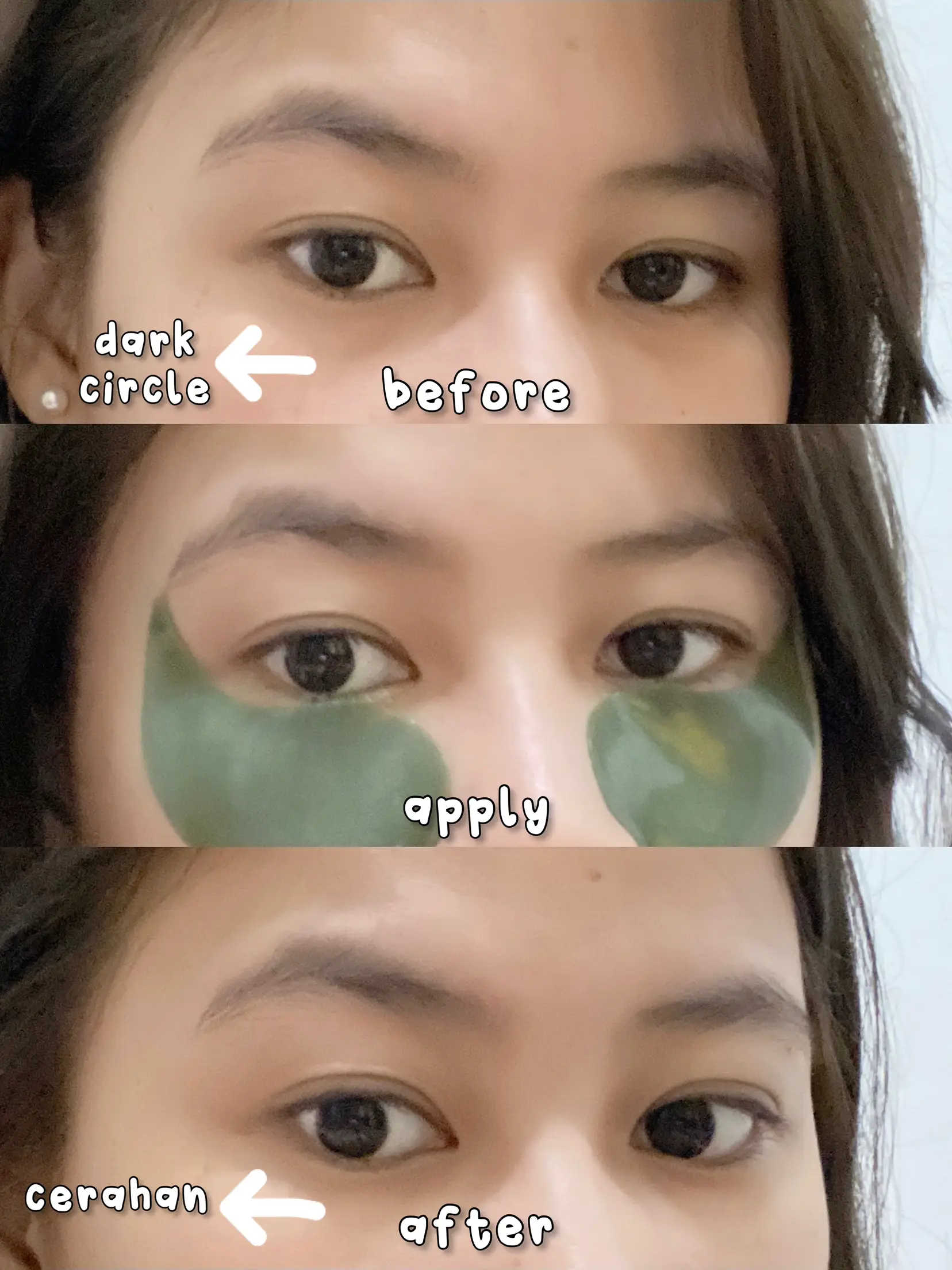 COBAIN EYEPATCH! | WORTH IT?🤔 | แกลเลอรีที่โพสต์โดย Rifani🌷 | Lemon8