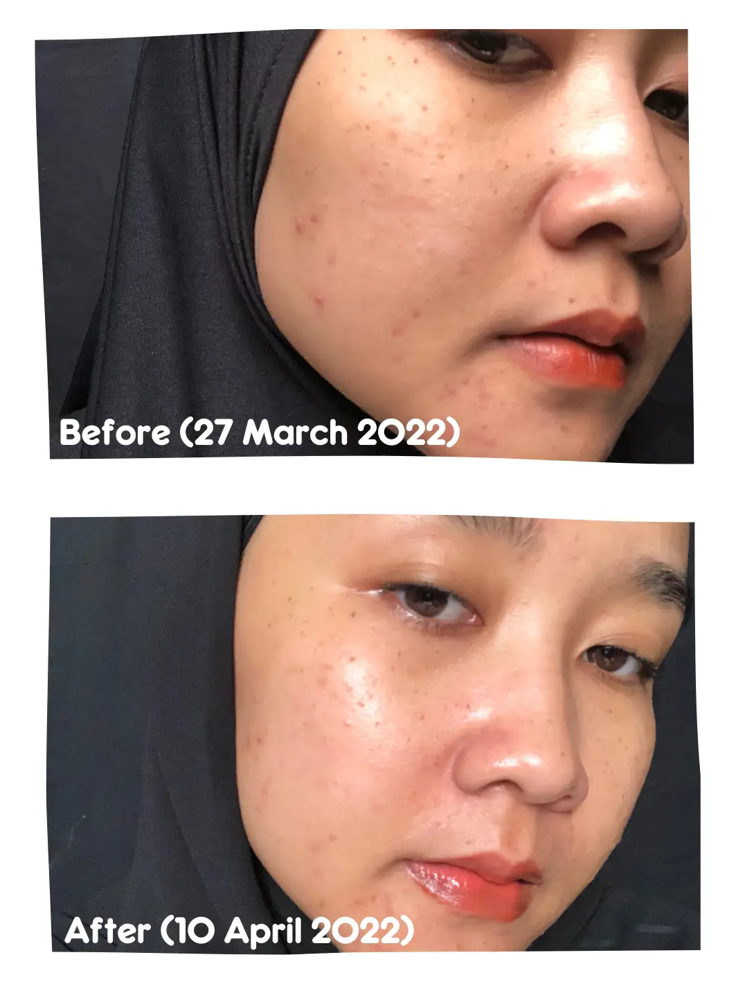 Custom Isa ke Serum Vit C | Galeri diposting oleh ameliawillys | Lemon8