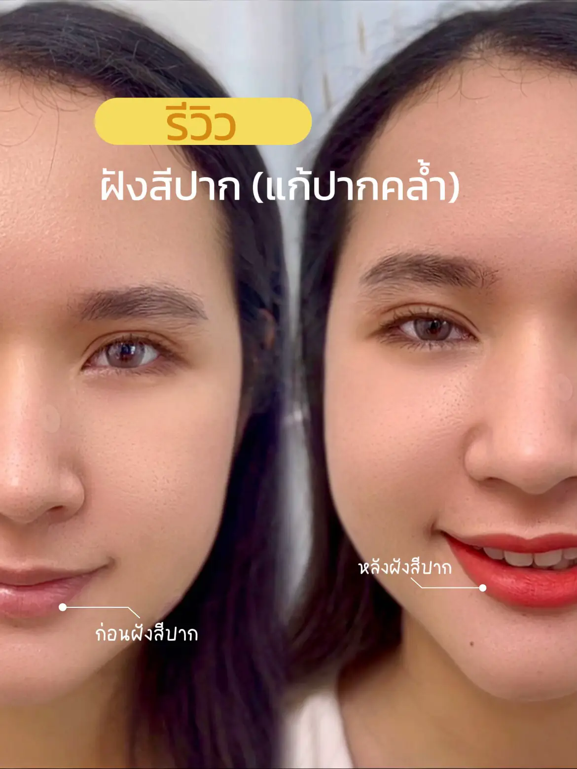 Review. Inlay lip color (fix dark mouth) | Video published by RUNWAY STUDIO | Lemon8