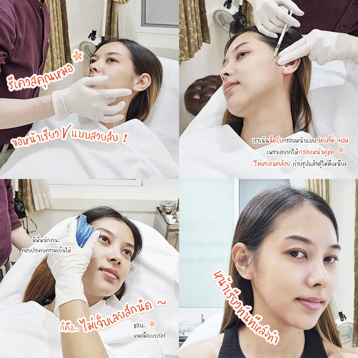 Botox lift กรอบหน้า ครั้งแรก ️ | แกลเลอรีที่โพสต์โดย aynuzii | Lemon8