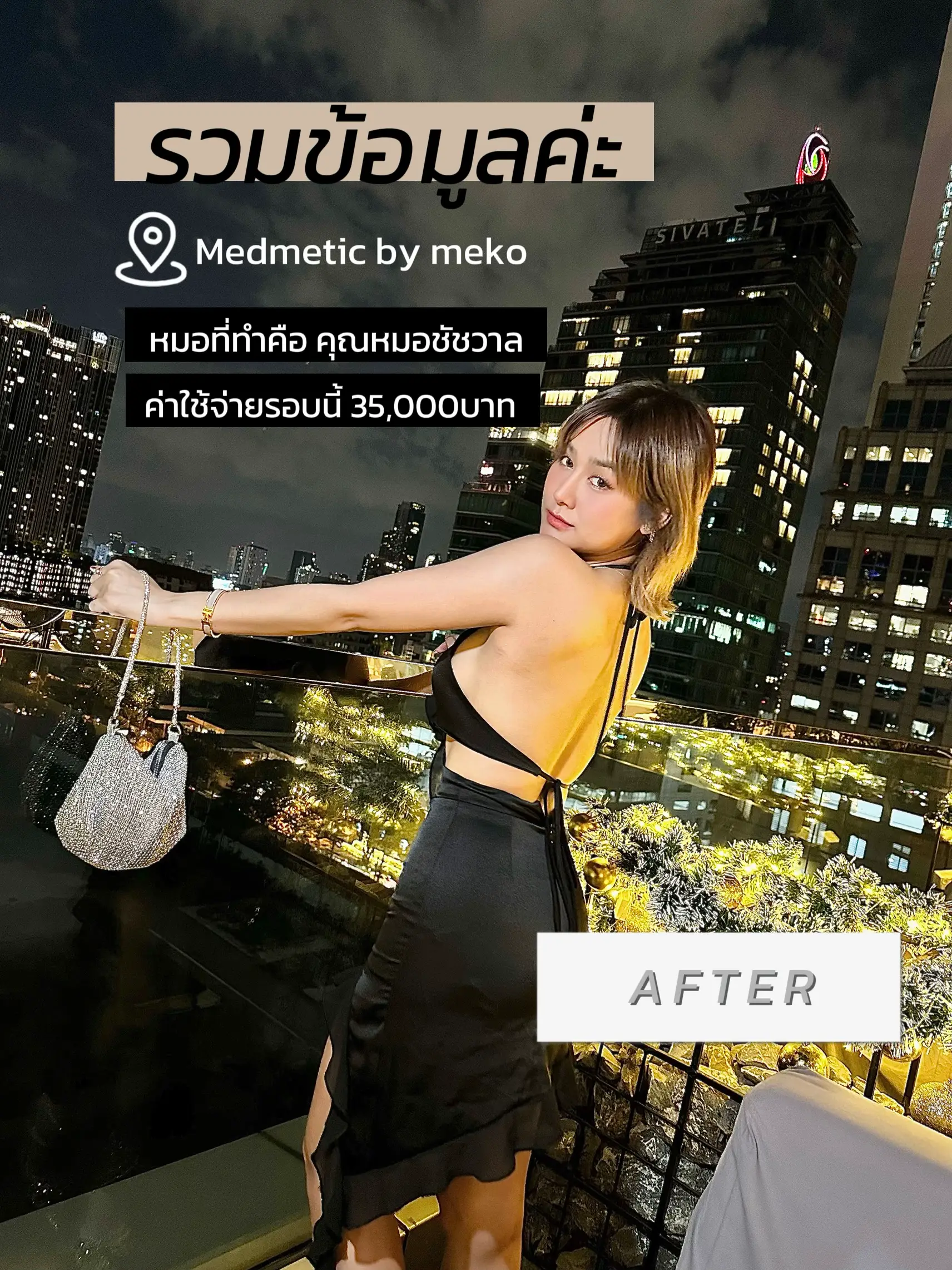 แก้จมูกรอบ2ปังหรือตุบมาดูกัน | แกลเลอรีที่โพสต์โดย Napatch.kat | Lemon8