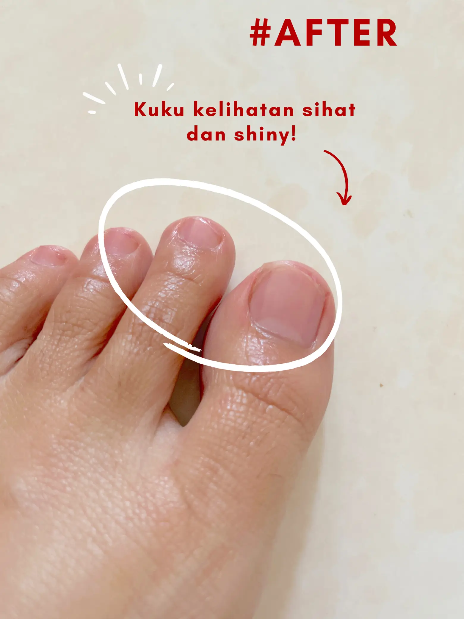 Perfect shiny nails without polish! 💅 | แกลเลอรีที่โพสต์โดย Farah ...