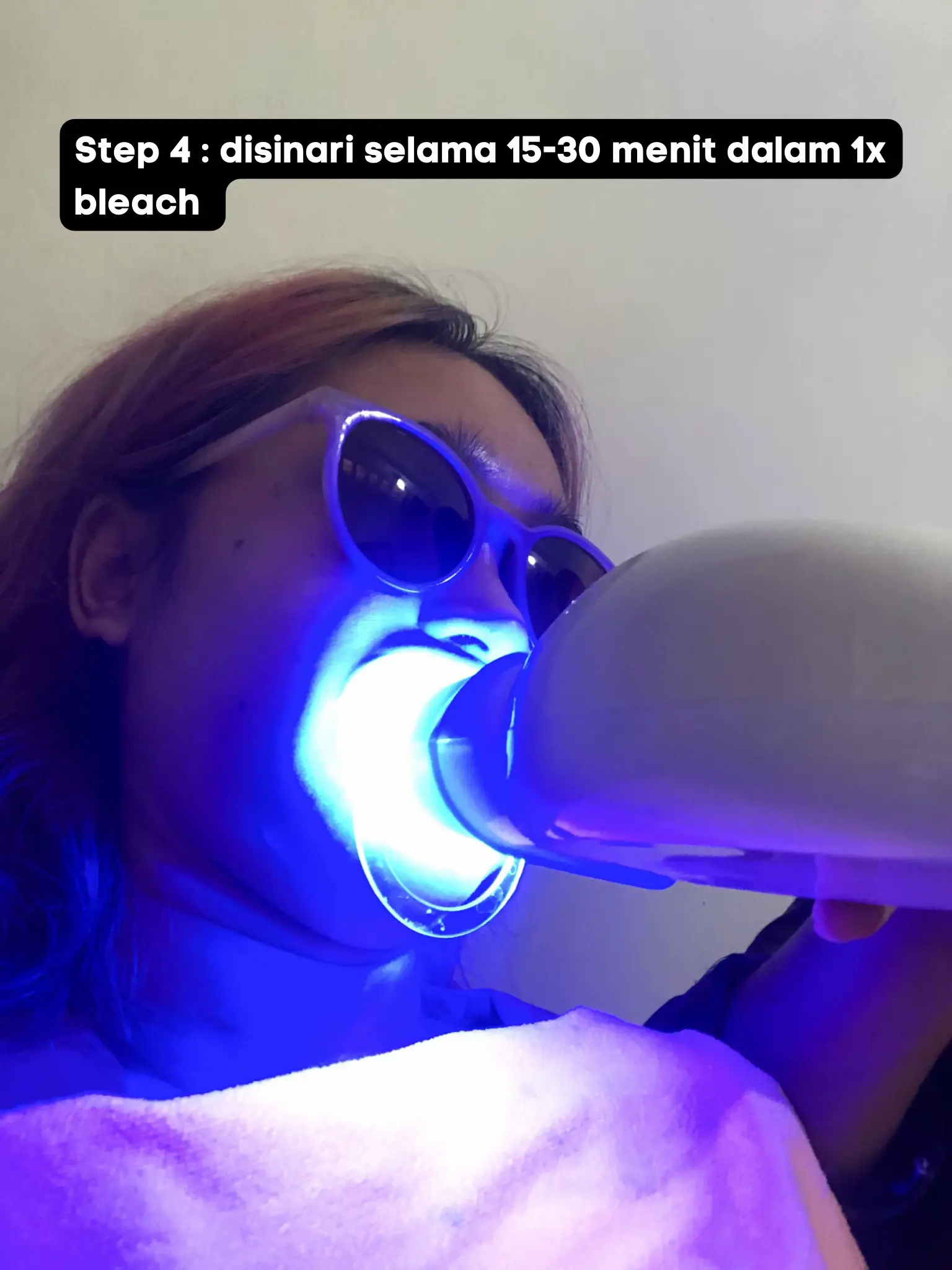 BLEACHING GIGI GRATIS!! | Galeri diposting oleh Yuka | Lemon8