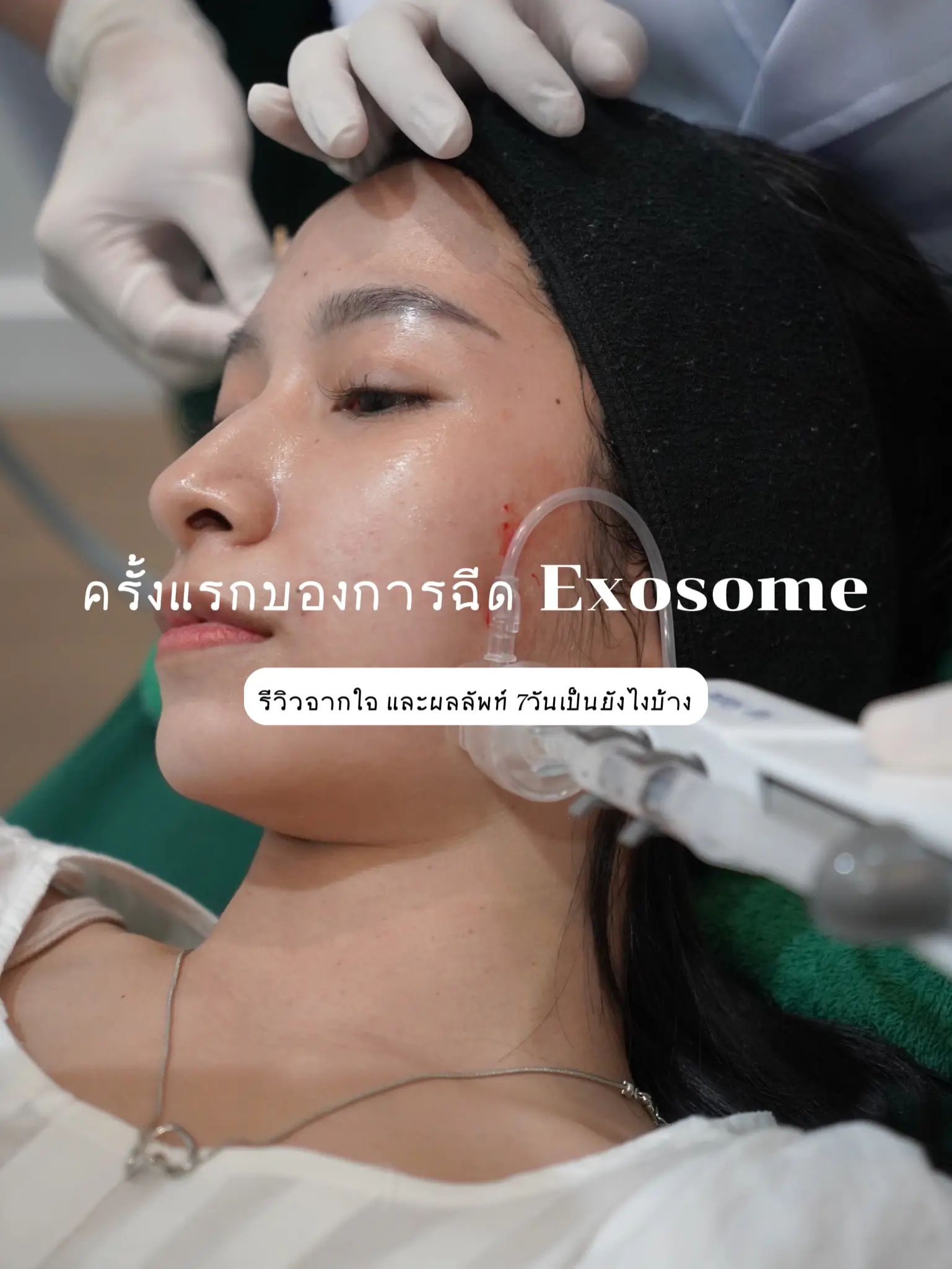 รีวิวฉีด exosome ที่เกาหลี Muse clinic แค่ 5,xxx บาท | แกลเลอรีที่โพสต์โดย noon💫 | Lemon8