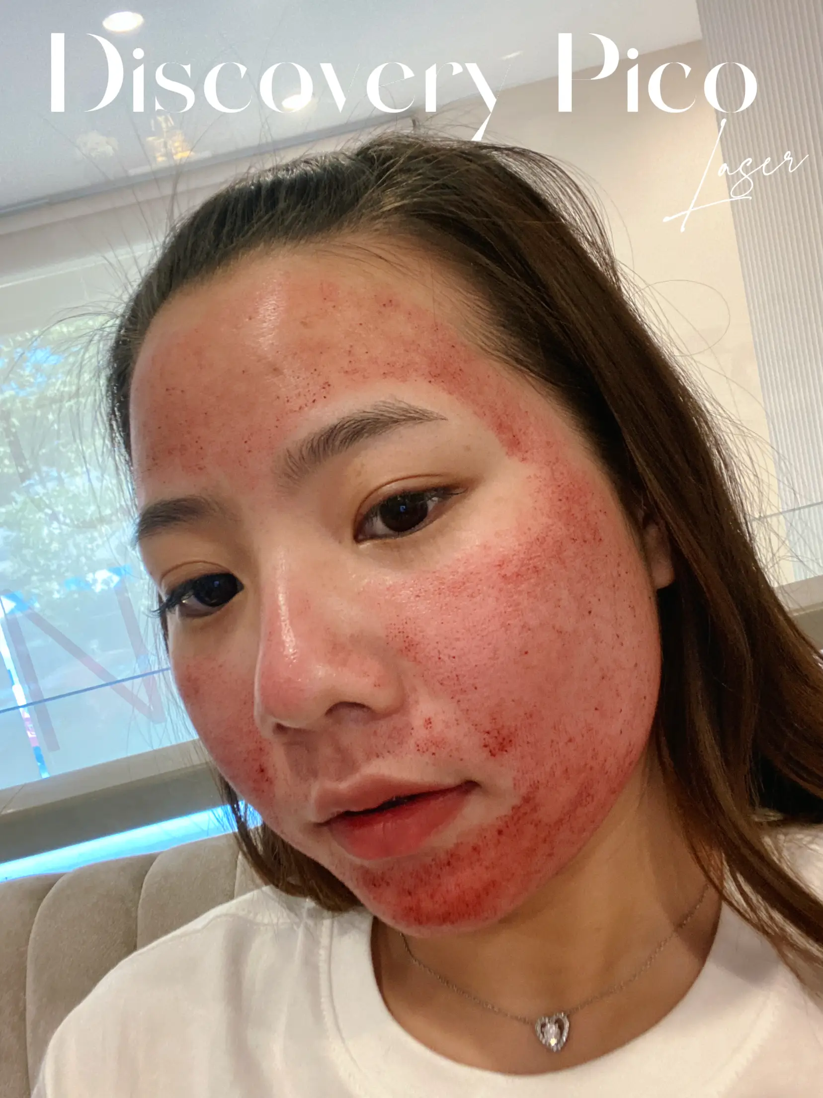 รีวิวพลีชีพ !!! Discovery Pico ปังจริงไหมม | แกลเลอรีที่โพสต์โดย TAMPAIGON | Lemon8