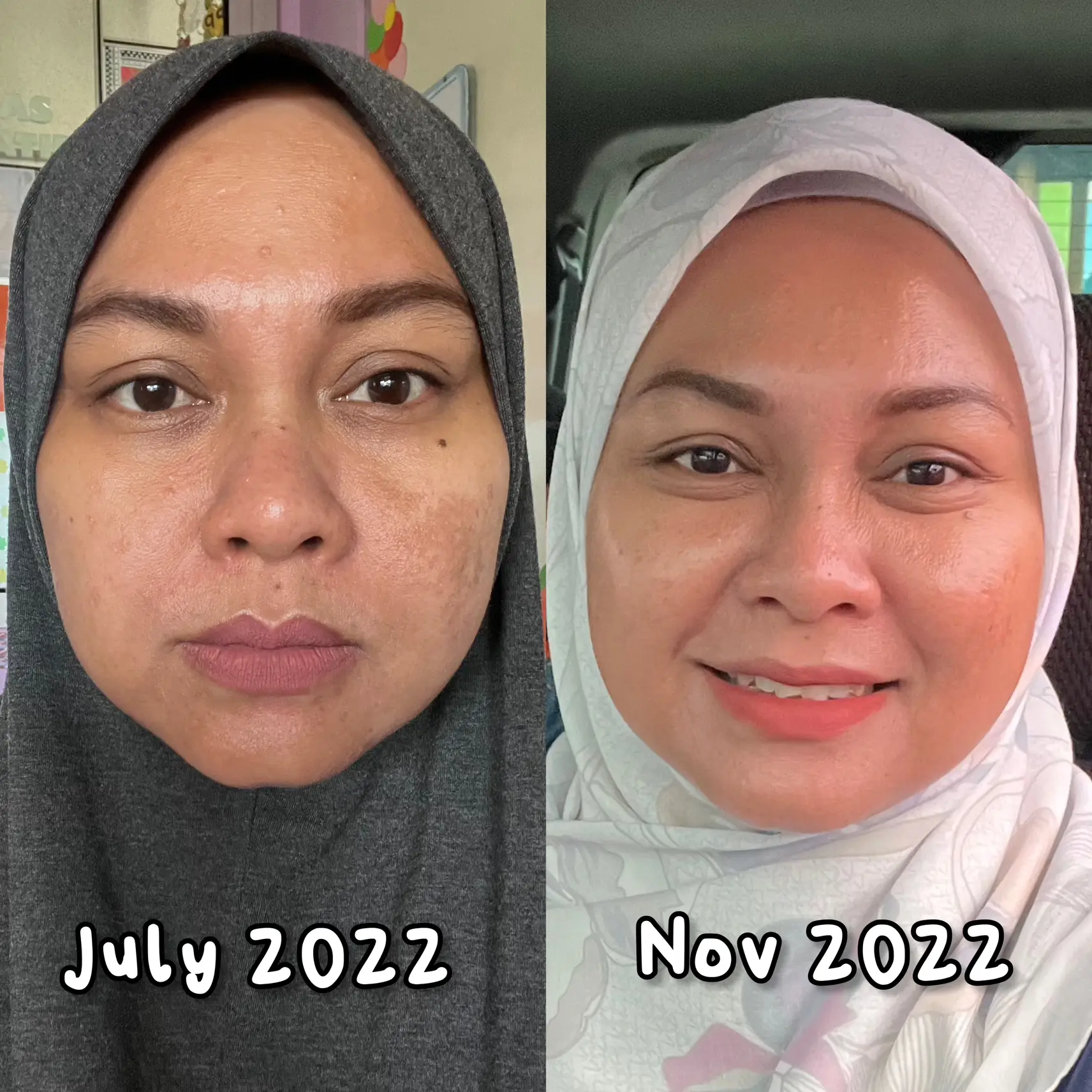 4 months journey | Galeri disiarkan oleh Nor Azwin Azlan | Lemon8