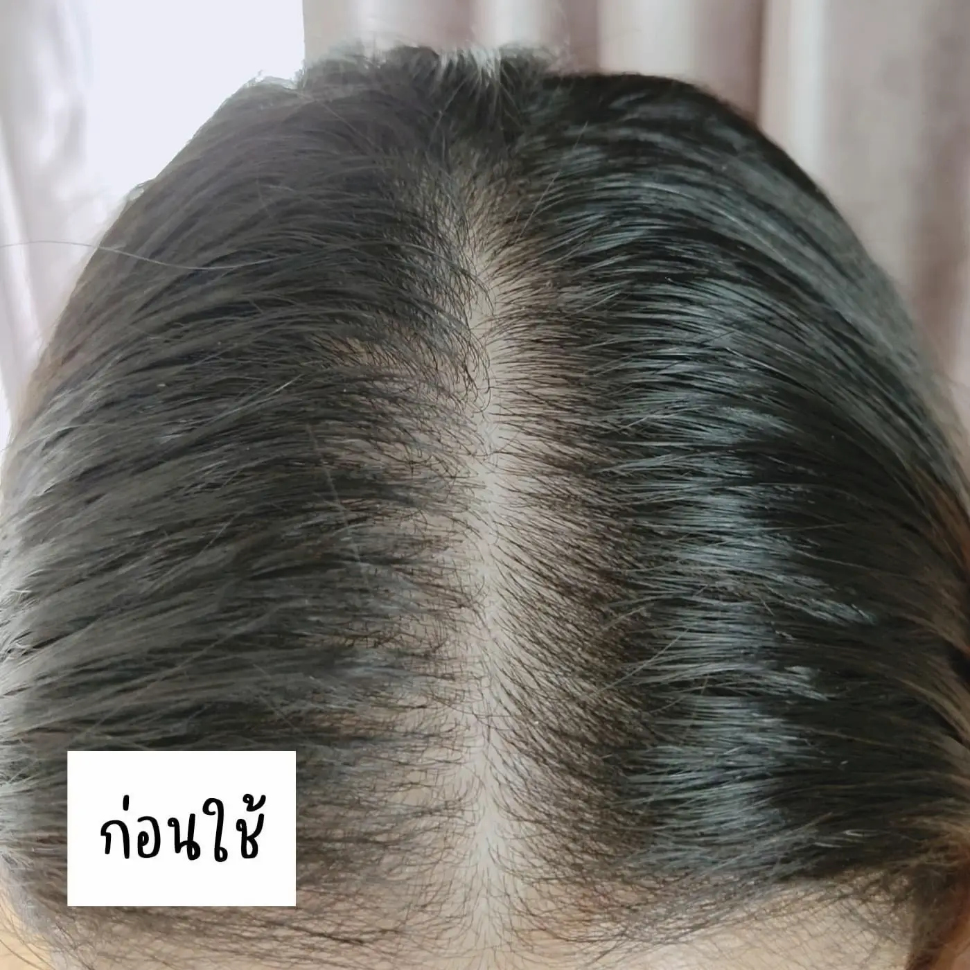 Closed bald, closed thin hair, but slapped, slapped, forfeited, mother ...