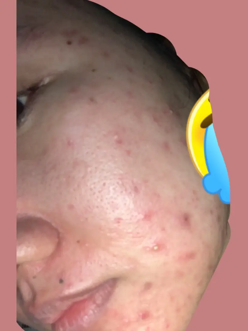 Breakout | Galeri diposting oleh Beyourself🌻🤍 | Lemon8