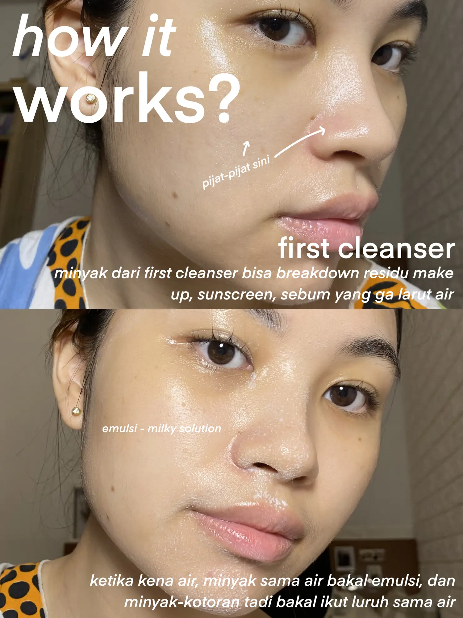 Acne 101: No More Pori Tersumbat dengan 2 PRODUK!🙅🏻 | Galeri diposting oleh Elliana Freya | Lemon8