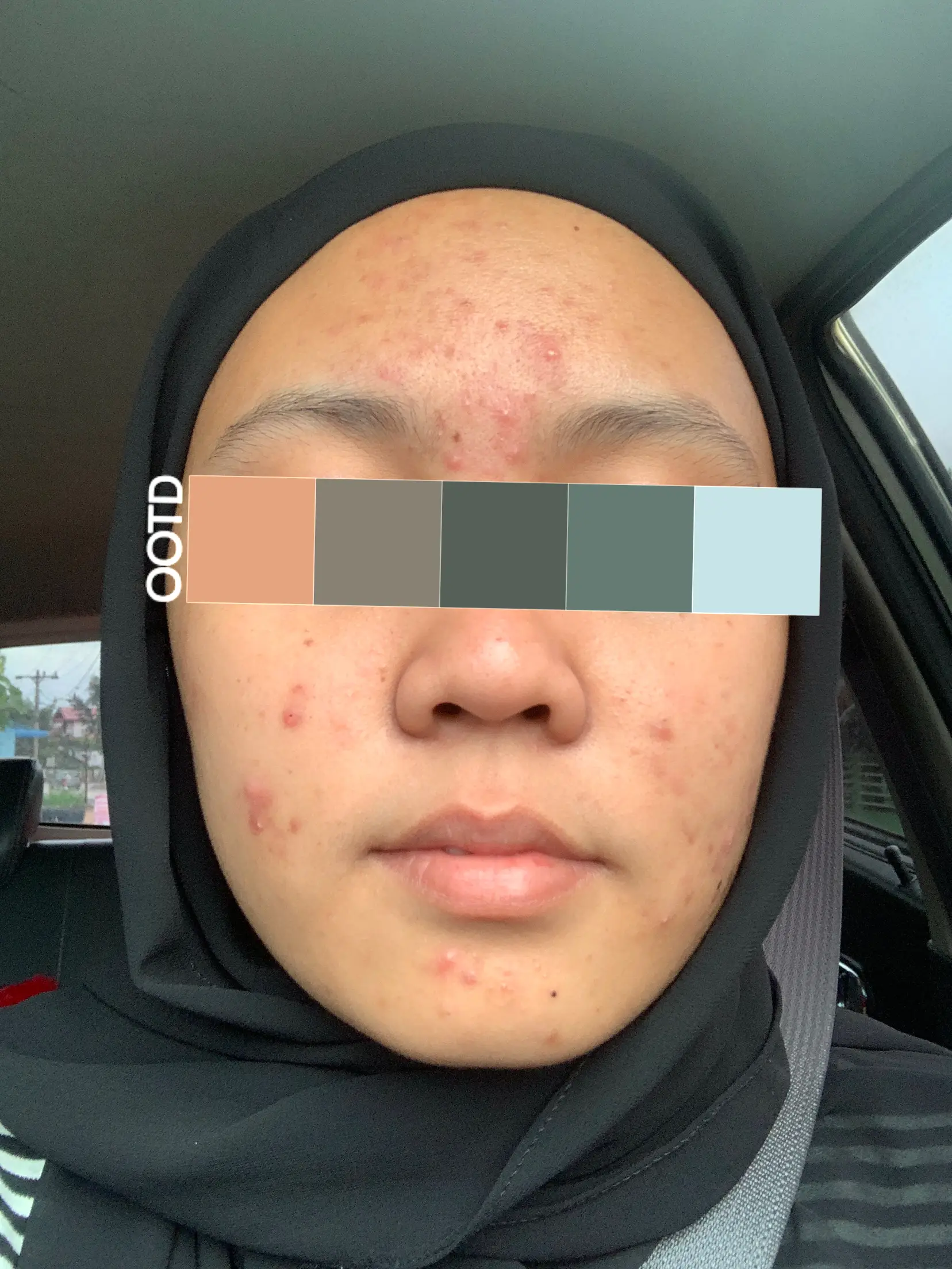 Breakout ga henti henti,sherin | Galeri diposting oleh Althea Dw | Lemon8