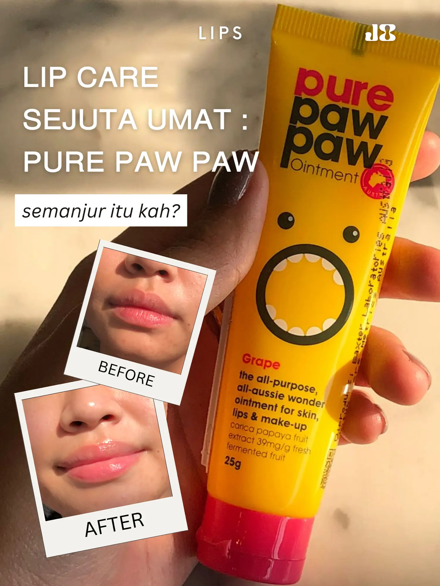 FIX YOUR LIPS NOW 👄 | Galeri diposting oleh mojojovita | Lemon8