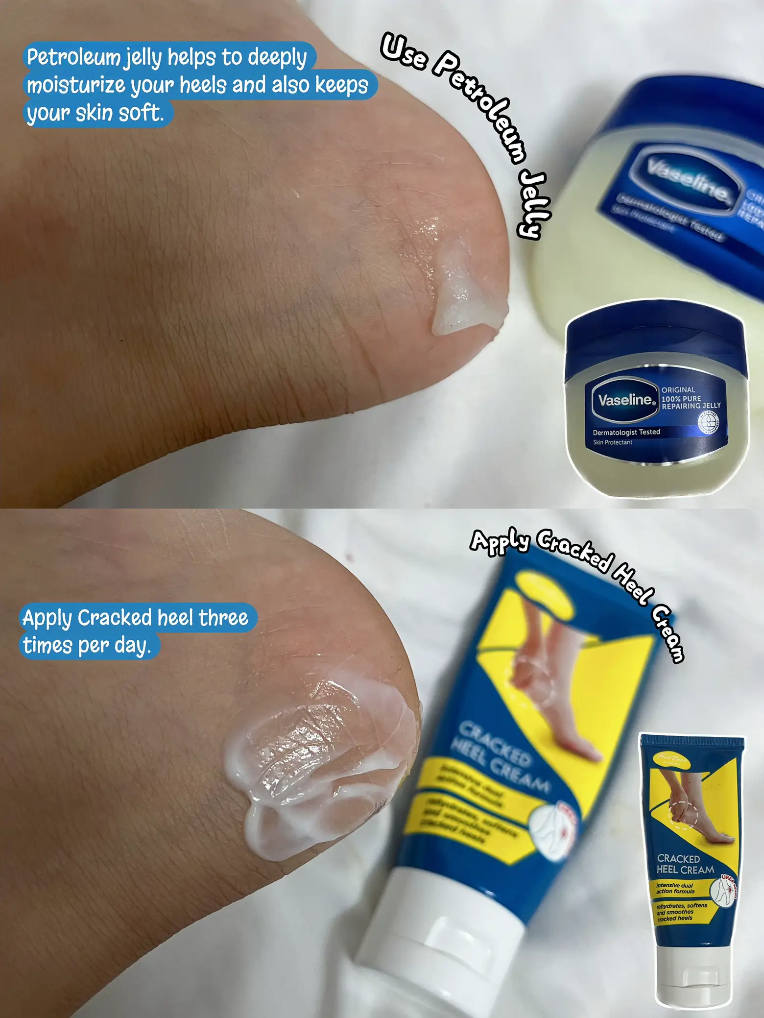 5 Solutions for Cracked Heels! | Galeri disiarkan oleh Marshanuffa | Lemon8