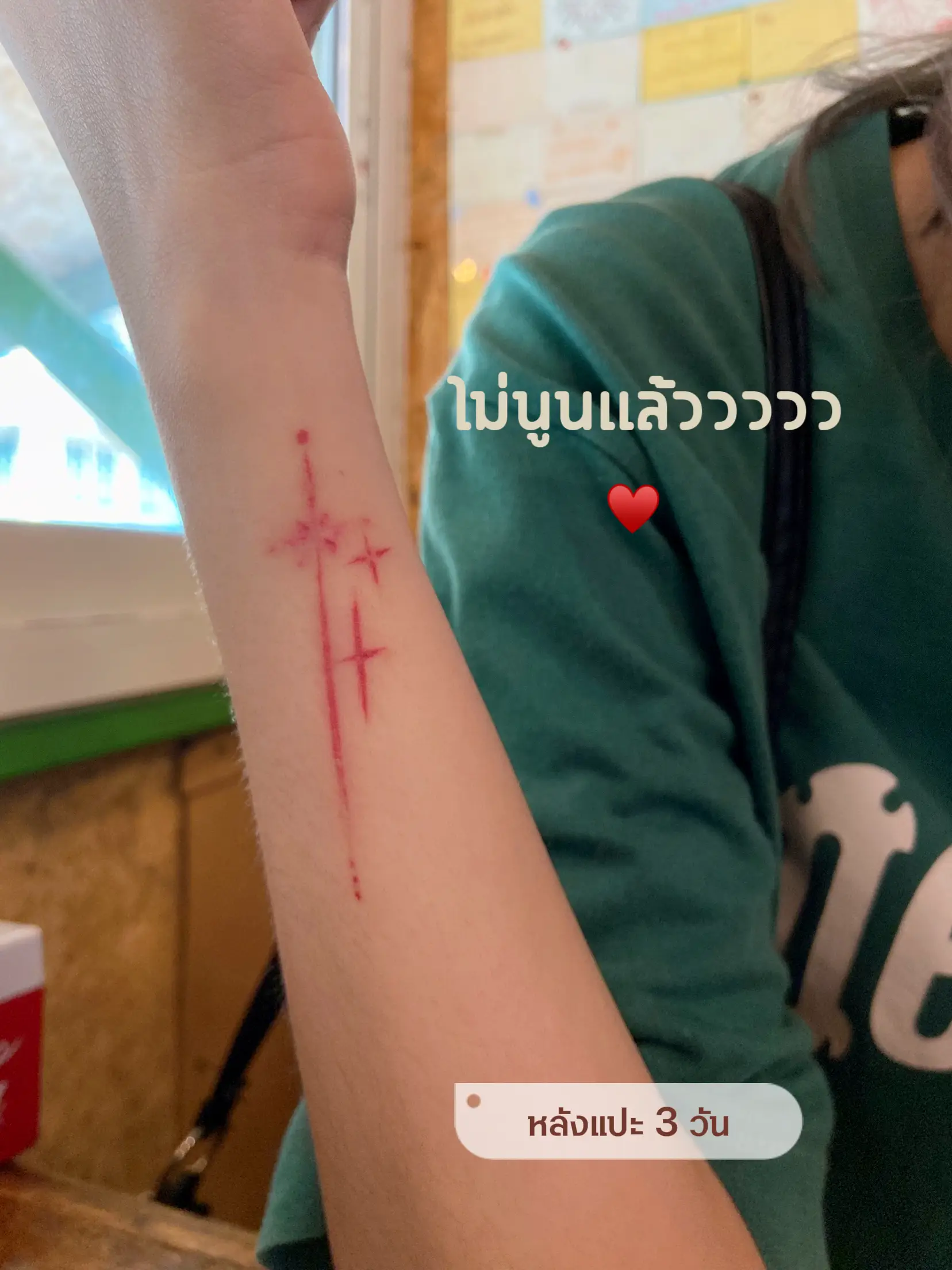 Embossed Anti-Scar Patch. Deaver! Expectations Happened. | Gallery ...