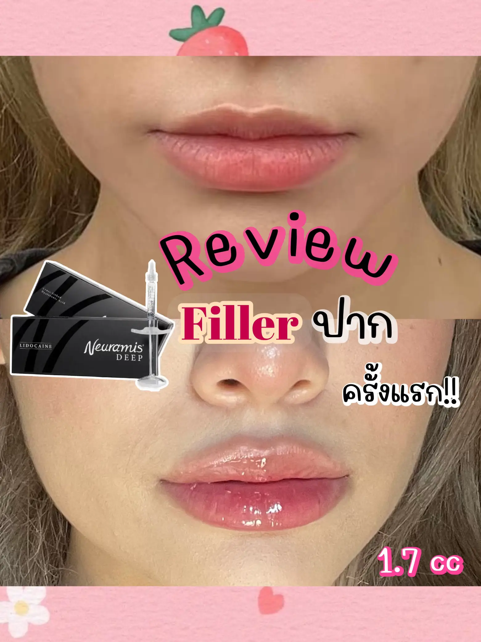 🦄Review Filler ปาก ครั้งแรก!!😨 | แกลเลอรีที่โพสต์โดย Helen 💖 | Lemon8