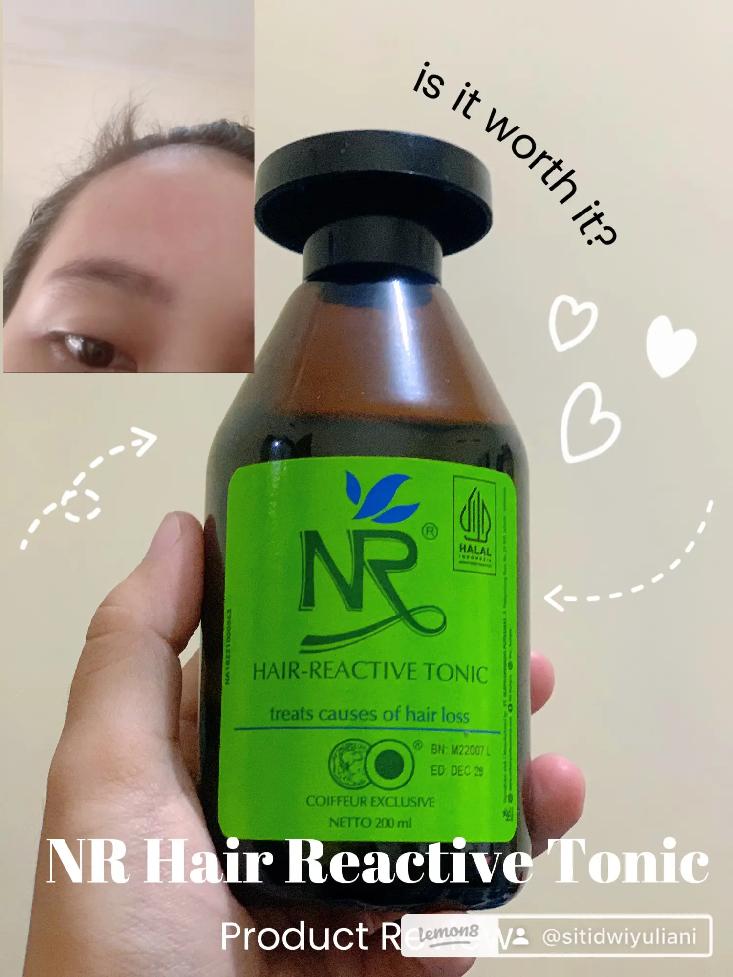 Pake produk ini rambut tumbuh kurang dari 2 minggu | Galeri diposting ...