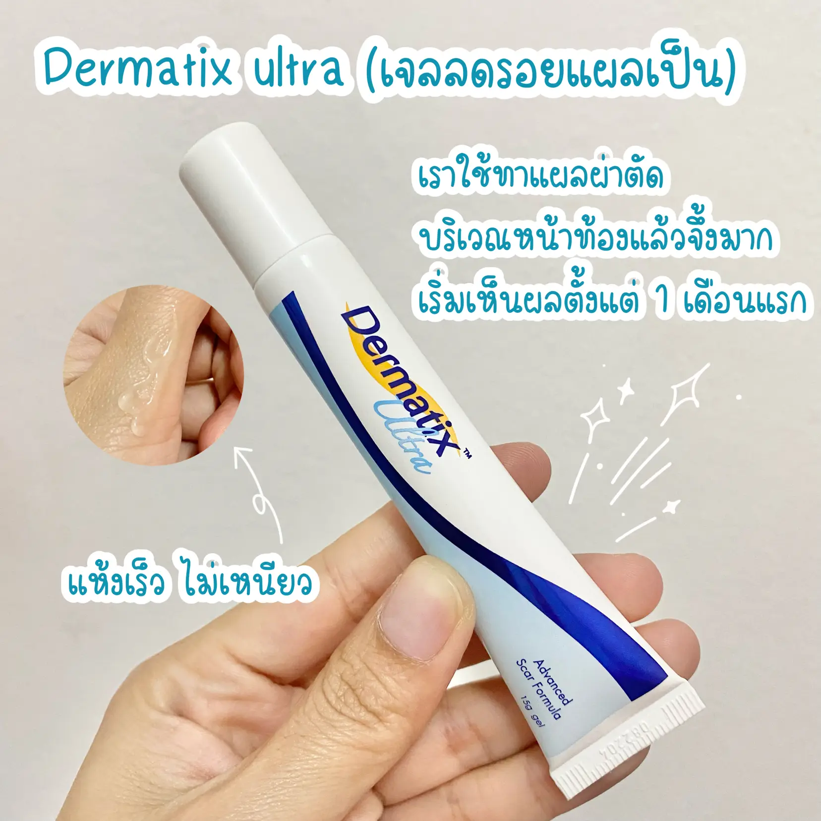 👑 Dermatix Ultra เจลลดรอยแผลในตำนาน ไม่ว่าจะรอยไหนก็อยู่ | แกลเลอรีที่ ...