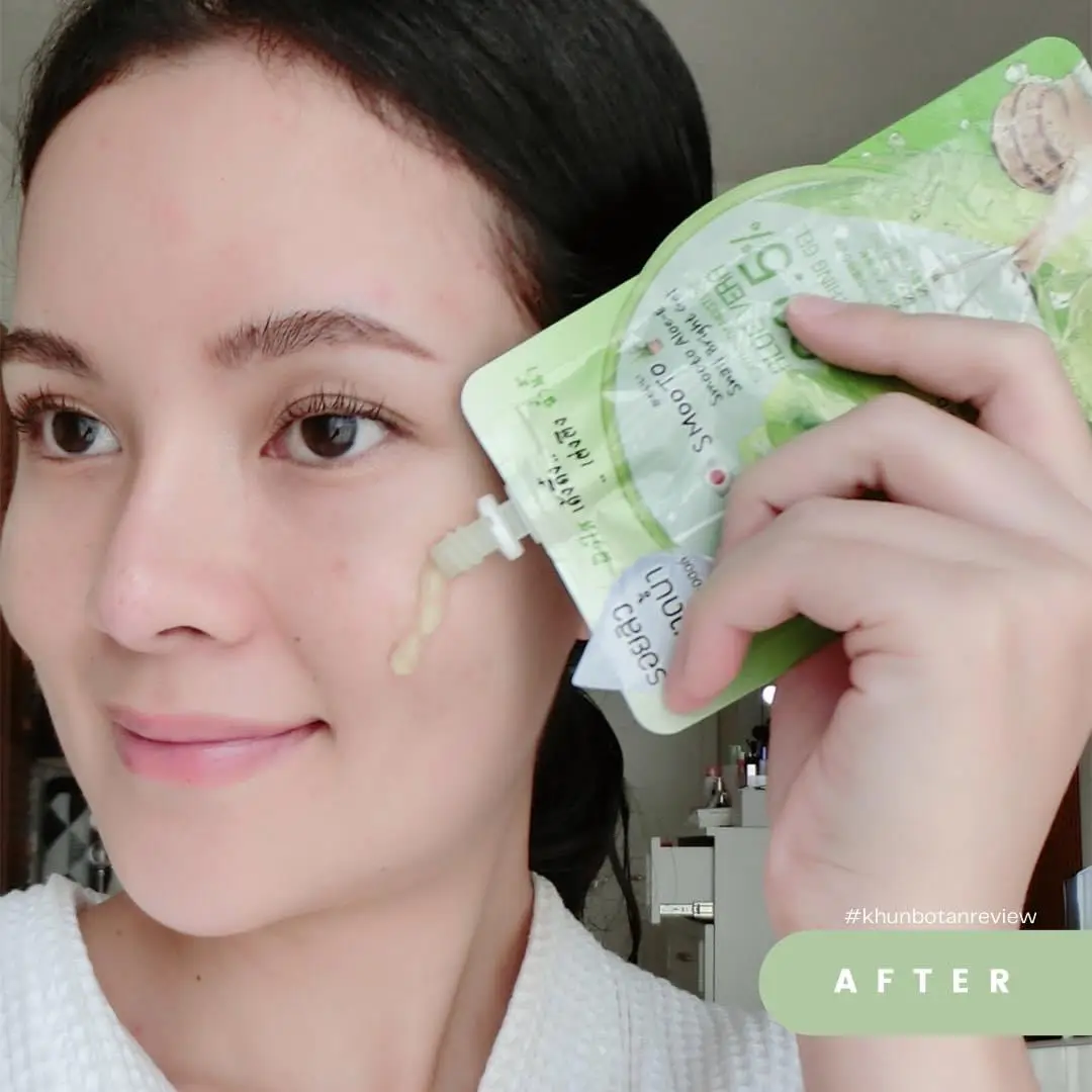 Pointing Acne Drops Items Clear Skin in Seven | Gallery posted by ...