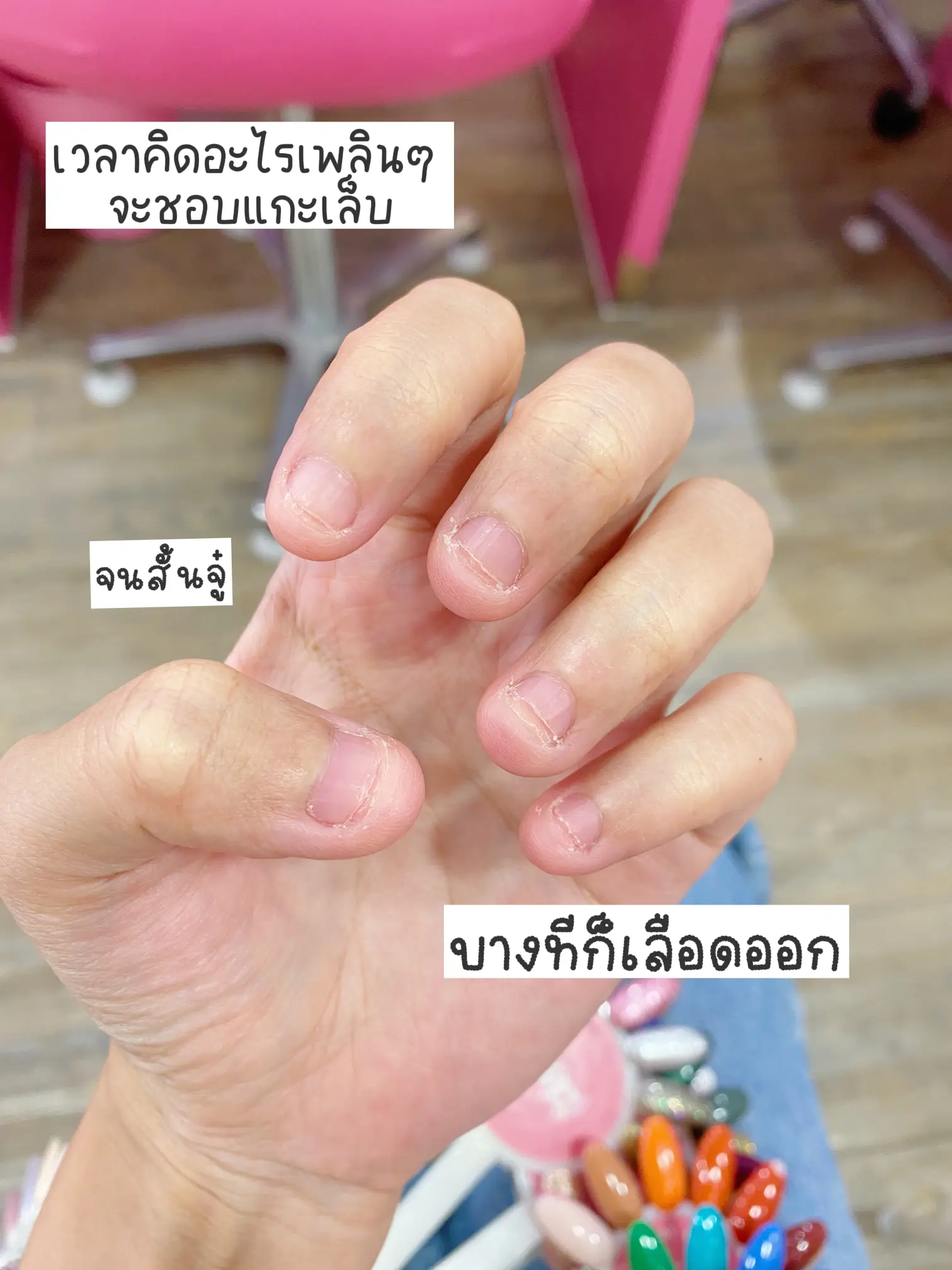 เล็บกุดแค่ไหน เรามีทางออก !! 💅🏻 | แกลเลอรีที่โพสต์โดย pp.pompaam | Lemon8