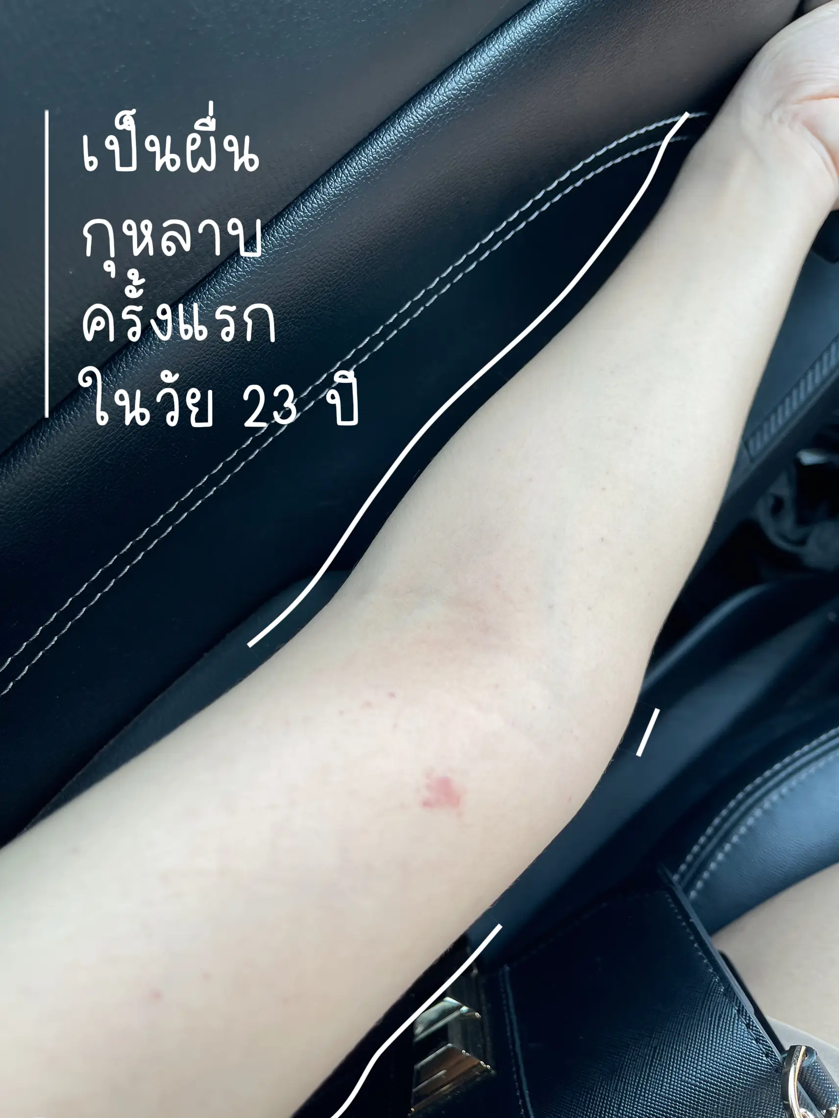 แชร์ประสบการณ์ฝังสีปากจ้า หัวเราะได้นะตามสบาย5555555 🥰 | แกลเลอรีที่ ...