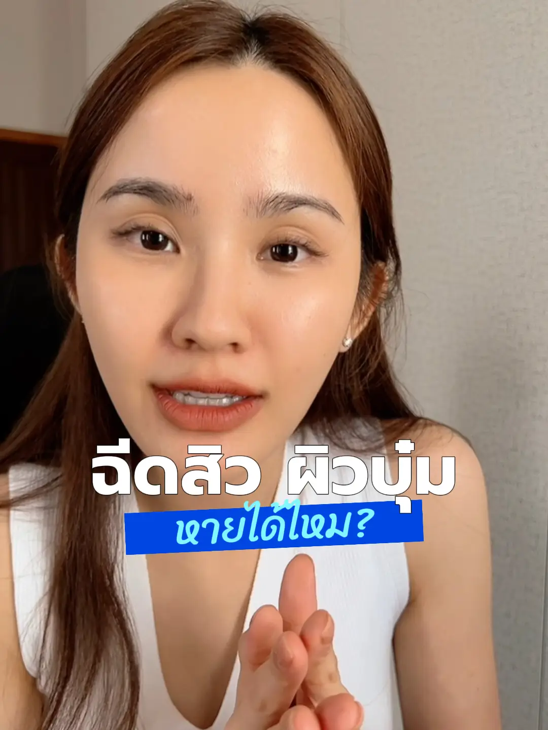 ฉีดสิวแล้วผิวบุ๋ม | วิดีโอที่เผยแพร่โดย Thewika T. | Lemon8