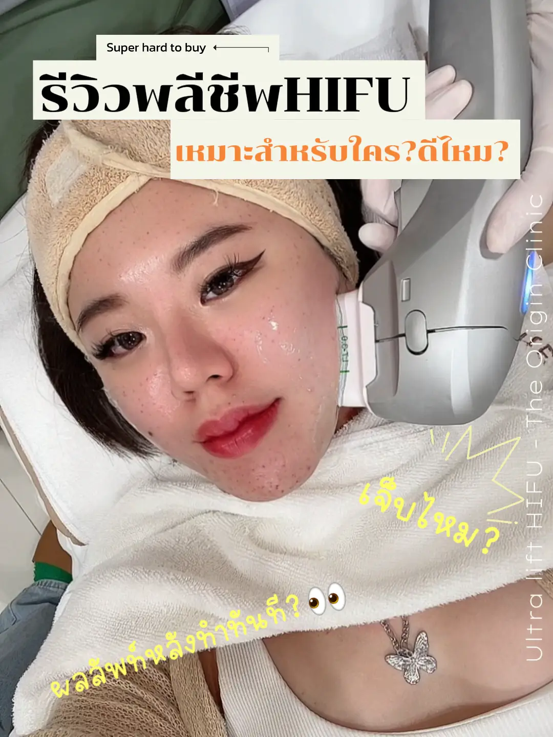 สายเซลฟี่ไปทำhifuด่วนนน! | แกลเลอรีที่โพสต์โดย Mossarellaaa | Lemon8